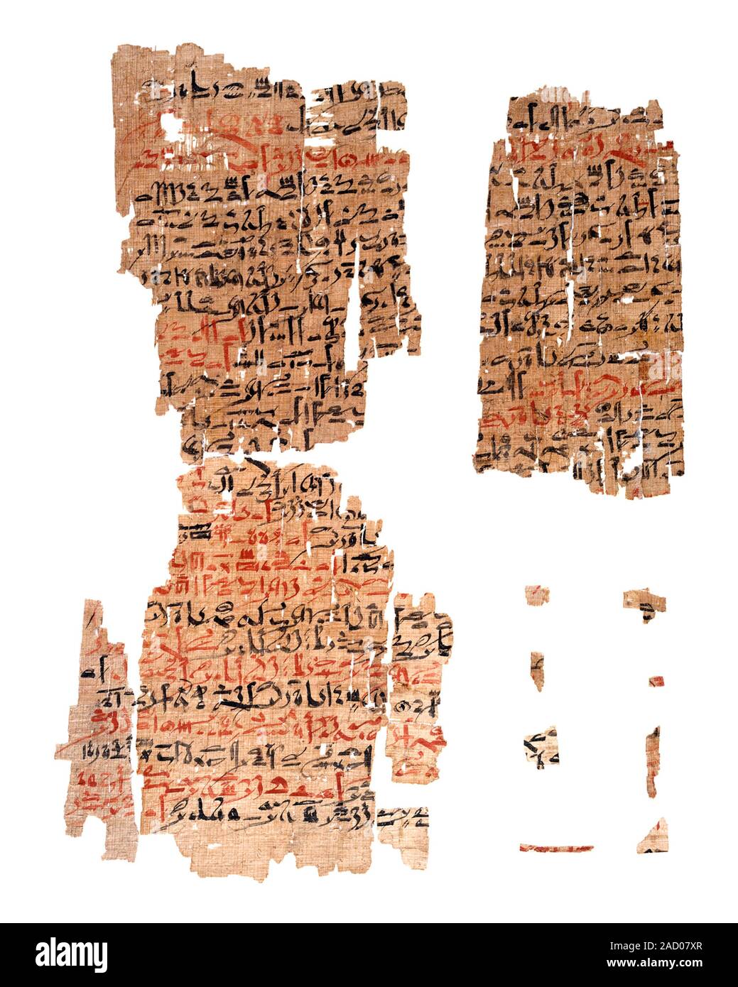 Edwin Smith Papyrus, Ancient Egyptian surgery. This papyrus is the ...