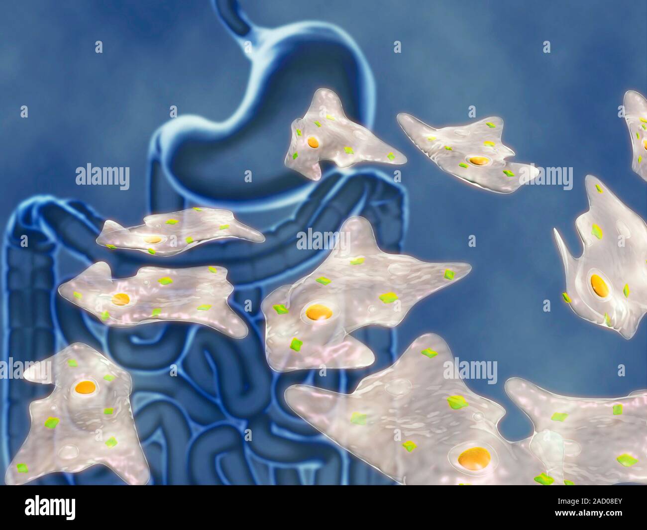 Amoebic dysentery infection. Illustration showing human digestive ...