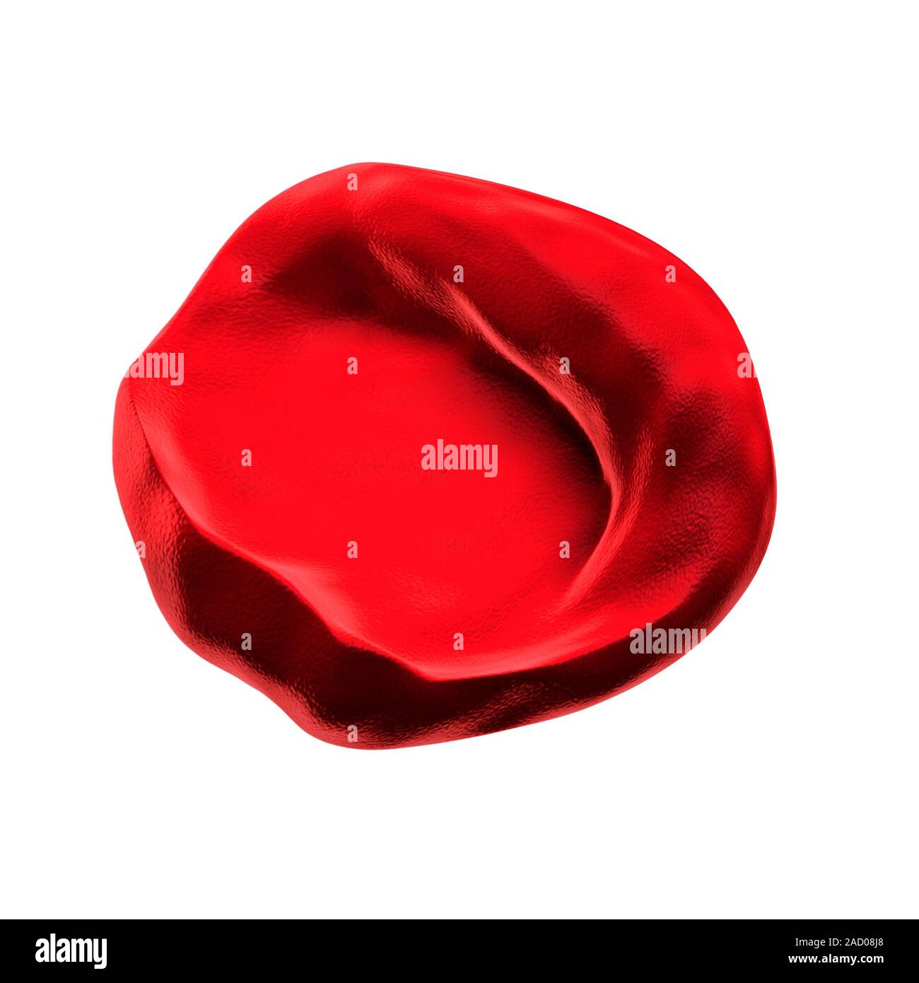 Stomatocyte. Illustration of a stomatocyte, an abnormal red blood cell ...