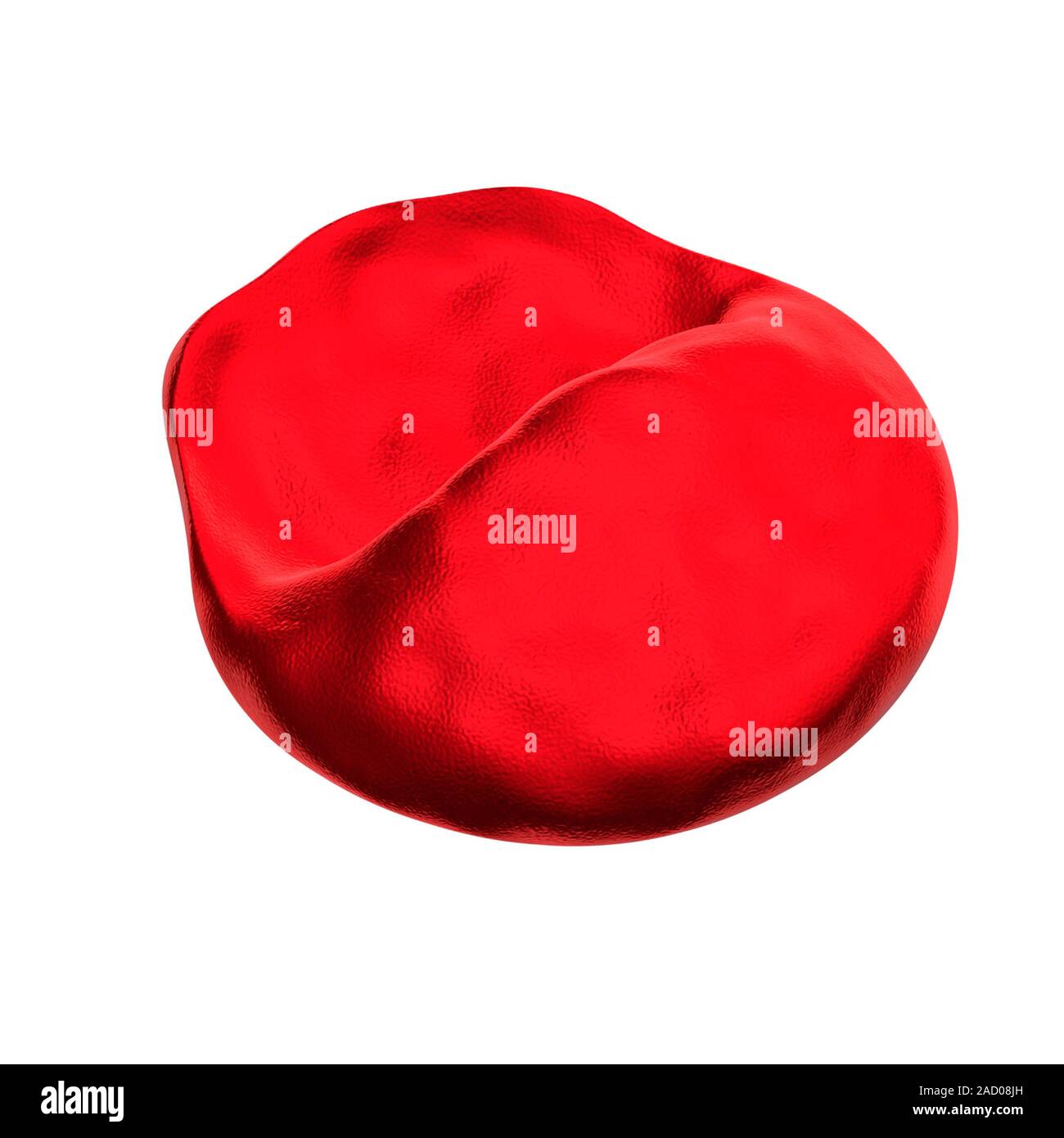 Stomatocyte. Illustration of a stomatocyte, an abnormal red blood cell ...