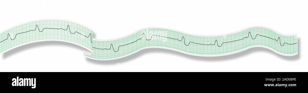 ECG. Computer illustration of an electrocardiogram (ECG Stock Photo - Alamy