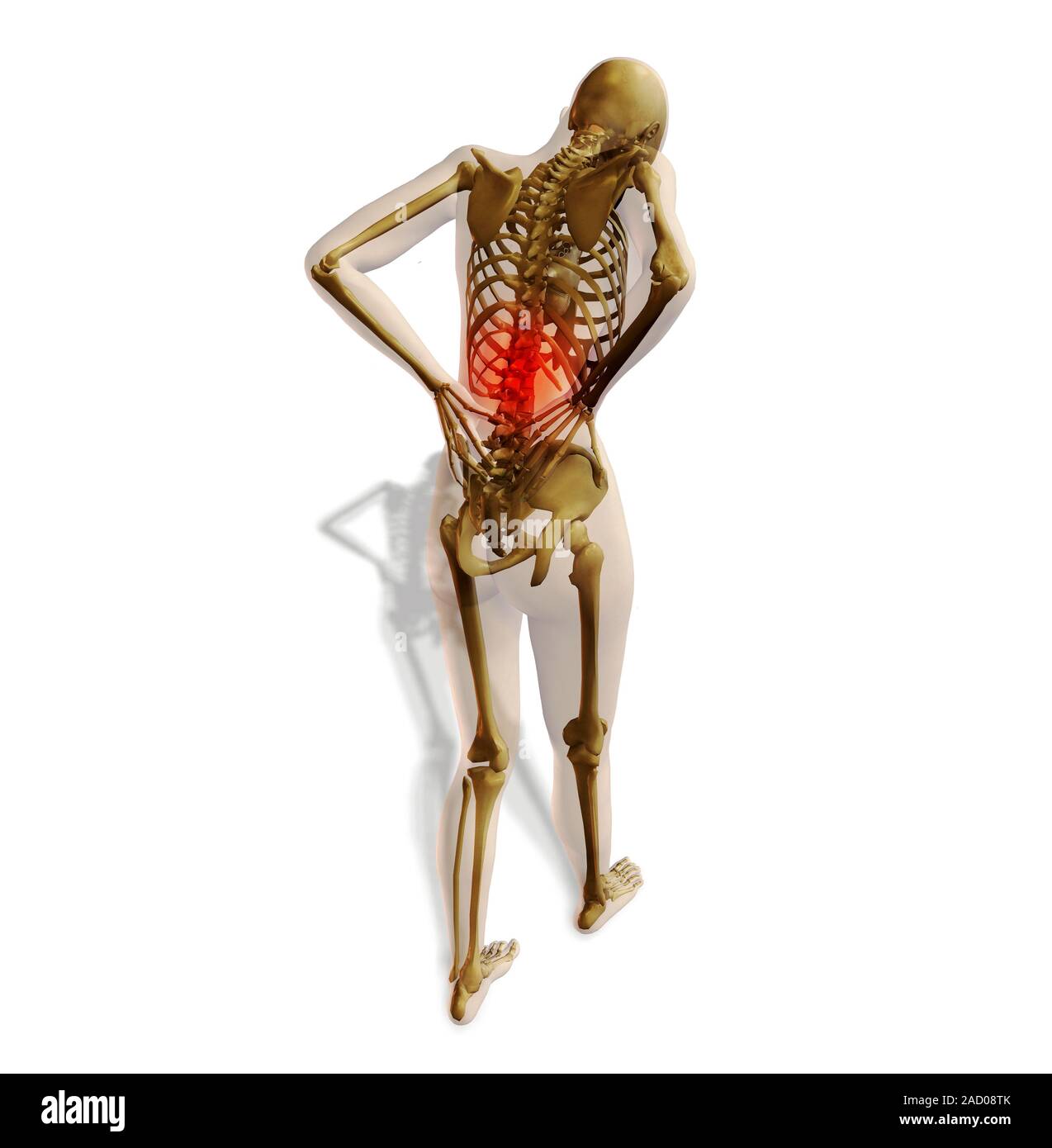 Human back pain, computer illustration Stock Photo - Alamy