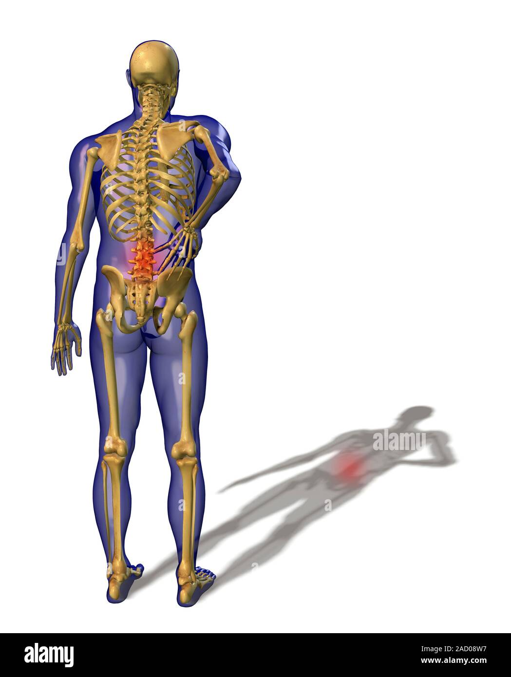 Human back pain, computer illustration Stock Photo - Alamy