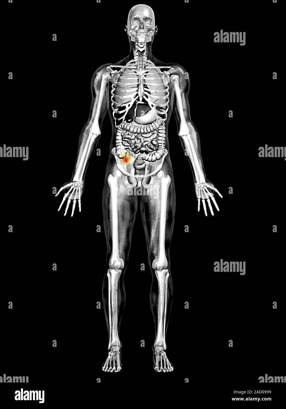 Human appendix, illustration. The skeleton is visible, and organs shown ...