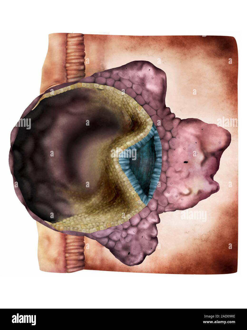 Implantation. Illustration of a human embryo implanting into the ...