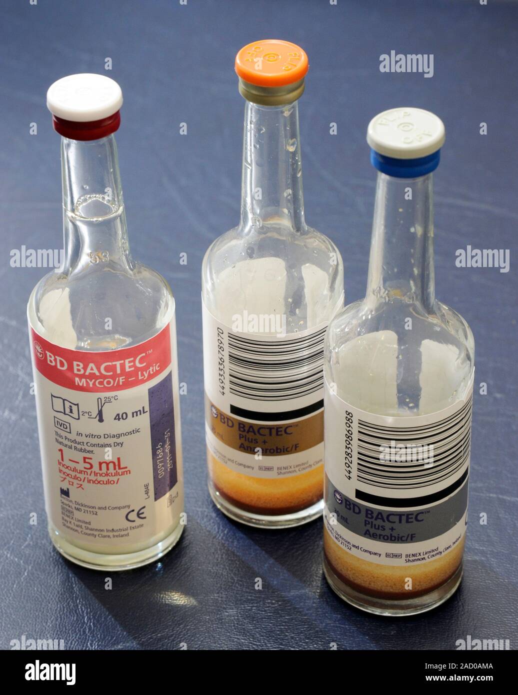 Blood bacteria cultures. Bottles containing bacteria cultured from ...