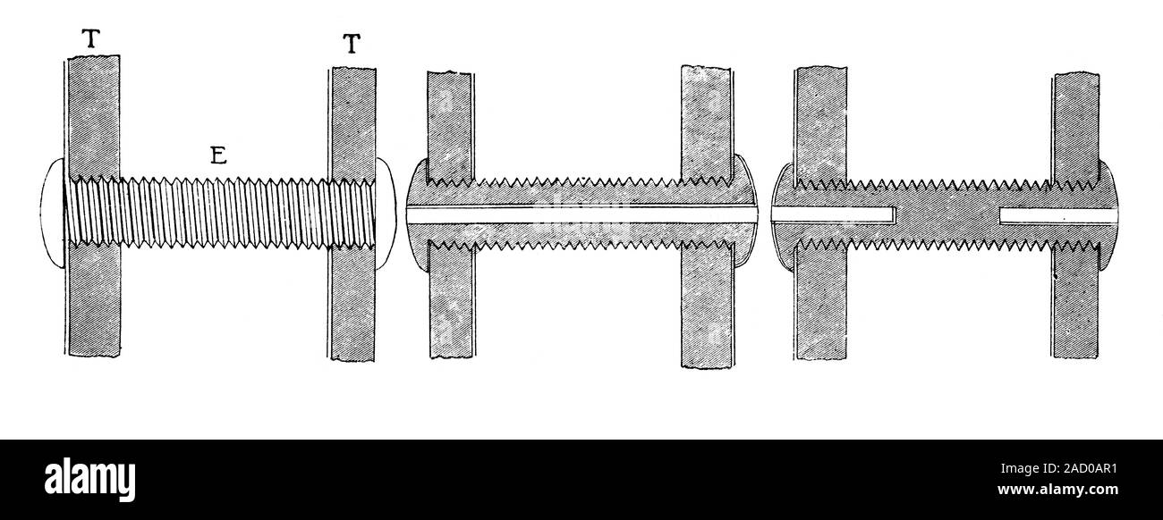 Steam engine braces. 19th-century illustration of copper braces used to ...