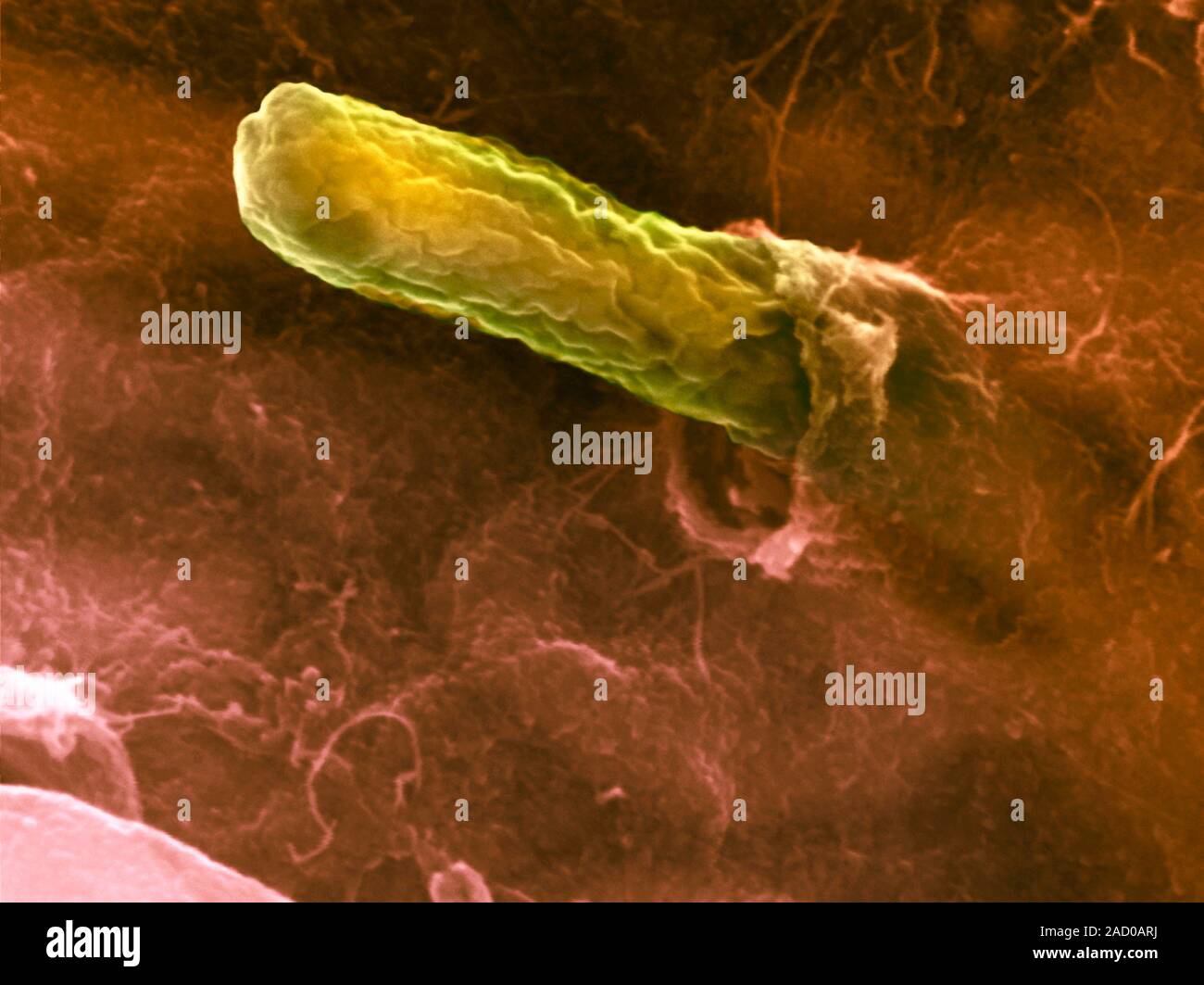Soya bean root nodule. Coloured scanning electron micrograph (SEM) of a ...