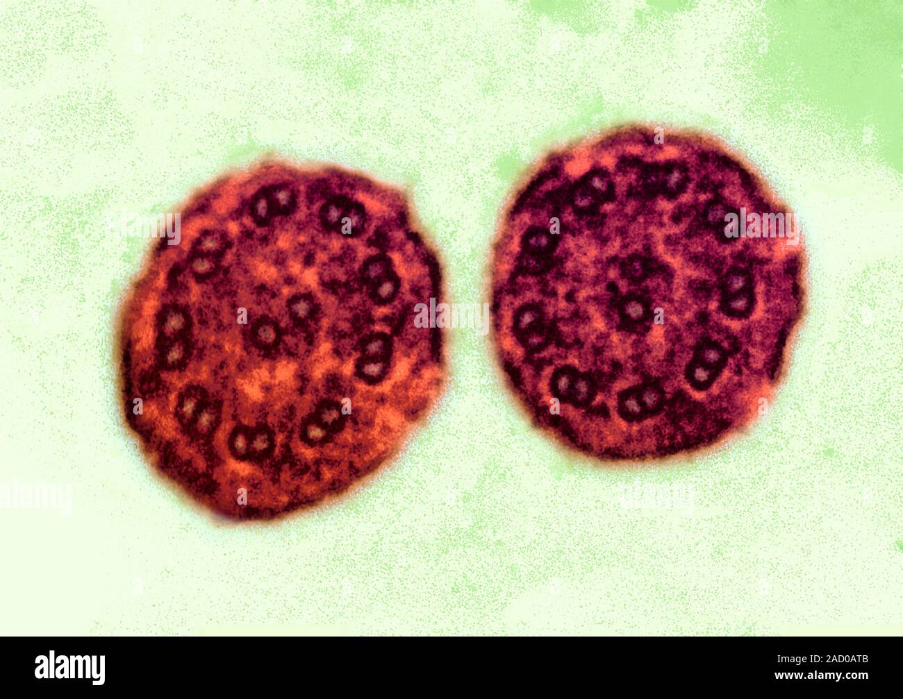 Respiratory cilia. Transmission electron micrograph (TEM) of a section ...