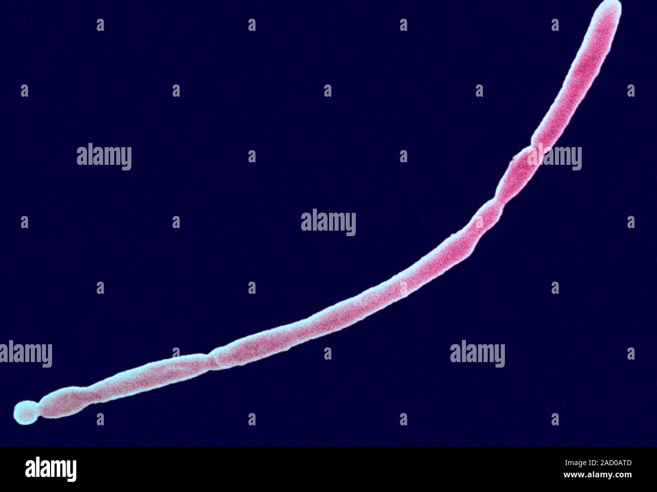 E. coli bacteria. Coloured scanning electron micrograph (SEM) of ...