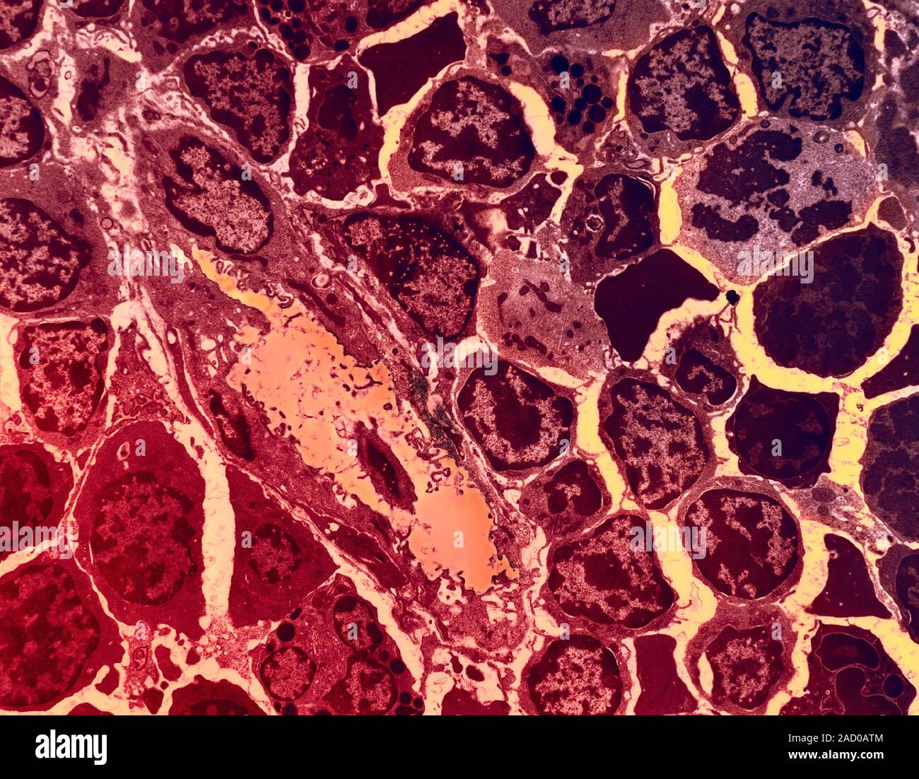 Kneecap bone marrow. Transmission electron micrograph of a section ...