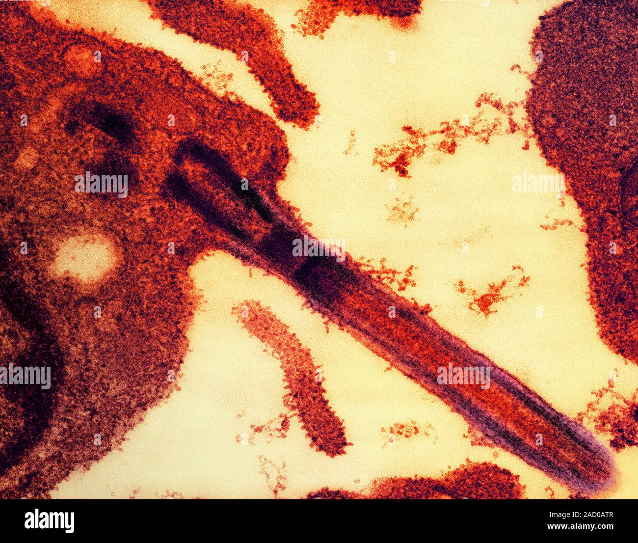Respiratory cilia. Transmission electron micrograph (TEM) of a section ...