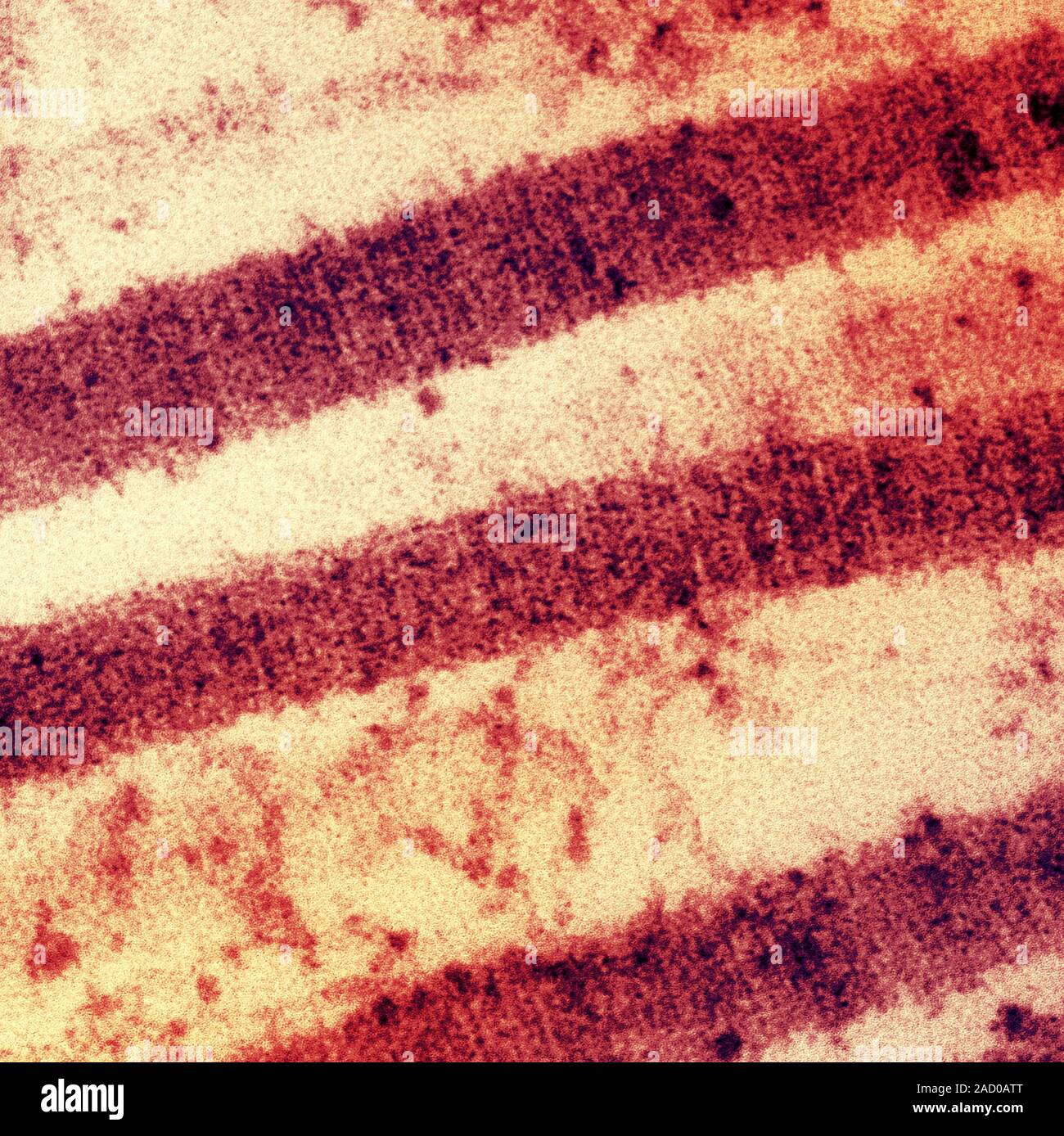 Lung collagen. Transmission electron micrograph (TEM) of a section ...