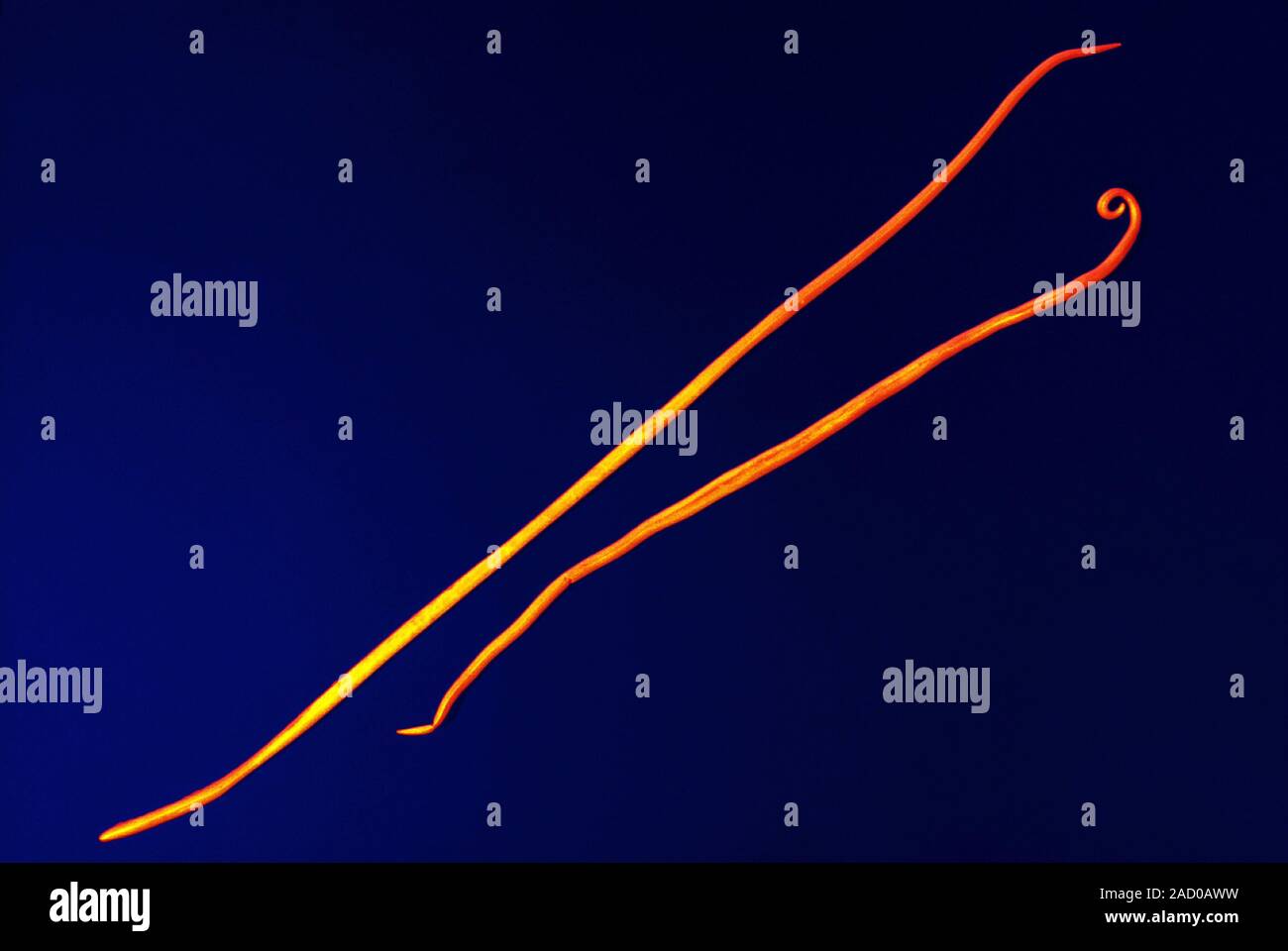 Parasitic roundworms. 1960s coloured scanning electron micrograph (SEM ...