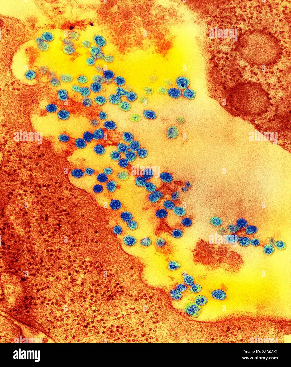 Rubella virus particles. Negatively-stained transmission electron ...