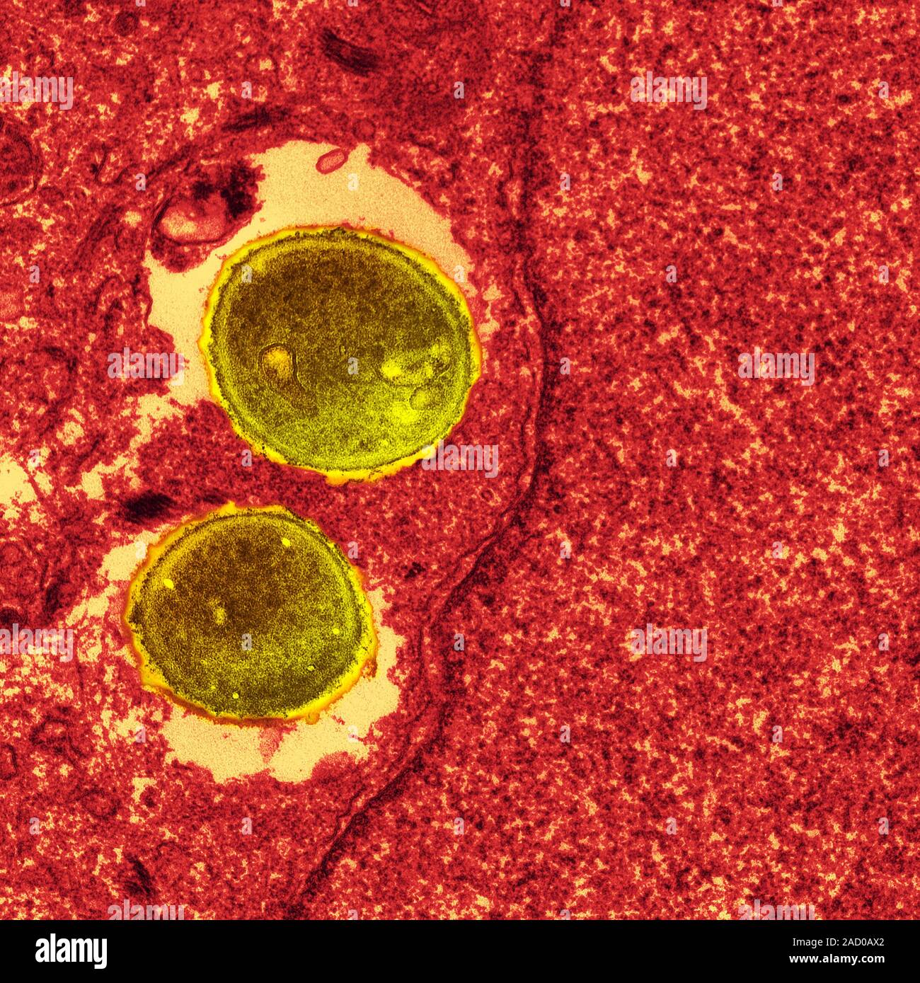 Staphylococcus aureus bacteria. Transmission electron micrograph (TEM ... Staphylococcus aureus bacteria. Transmission electron micrograph (TEM ...