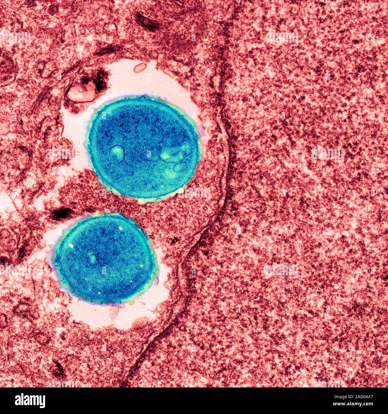 Staphylococcus aureus bacteria. Transmission electron micrograph (TEM ... Staphylococcus aureus bacteria. Transmission electron micrograph (TEM ...