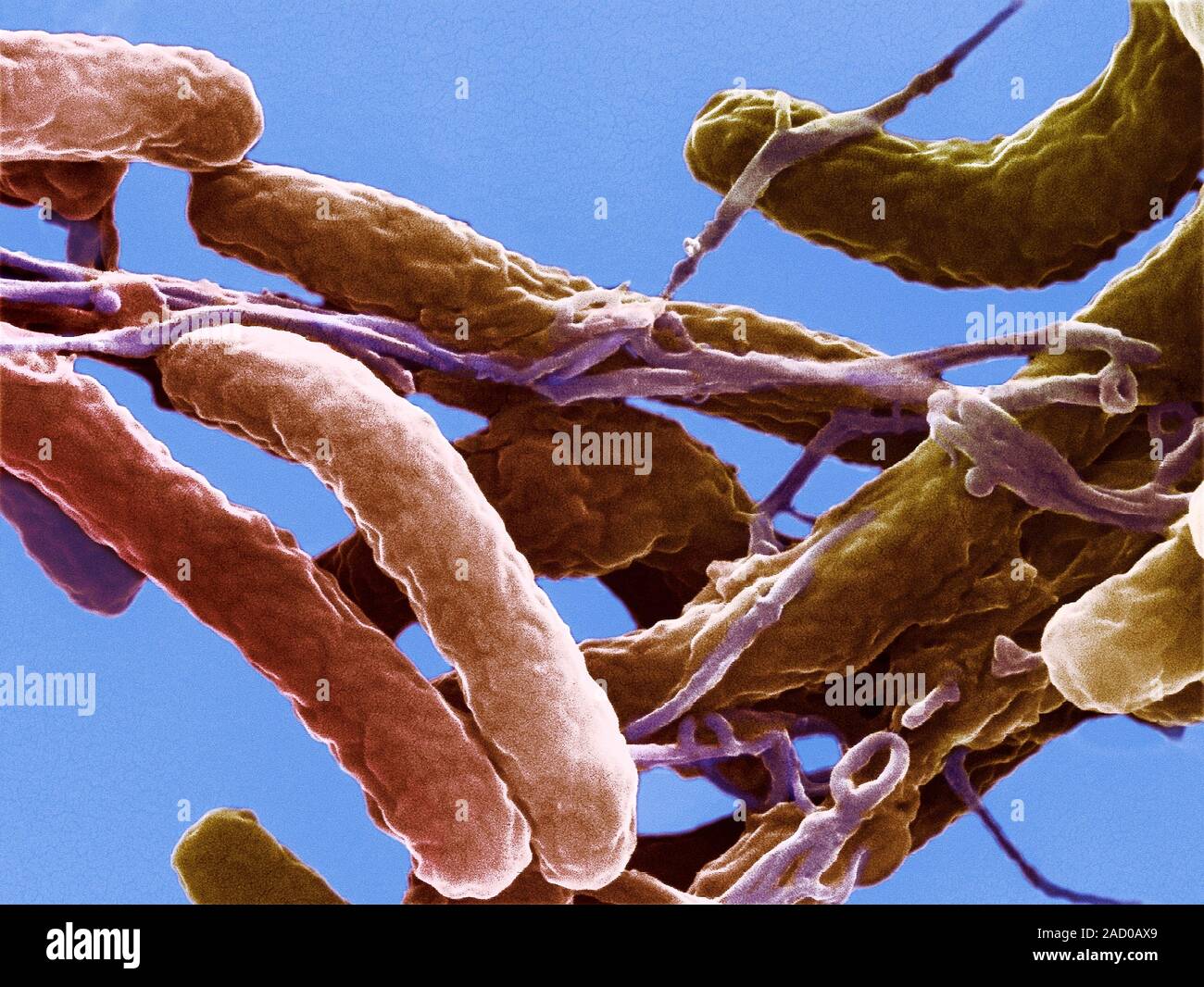 Cholera bacteria. Coloured scanning electron micrograph (SEM) of Vibrio ...