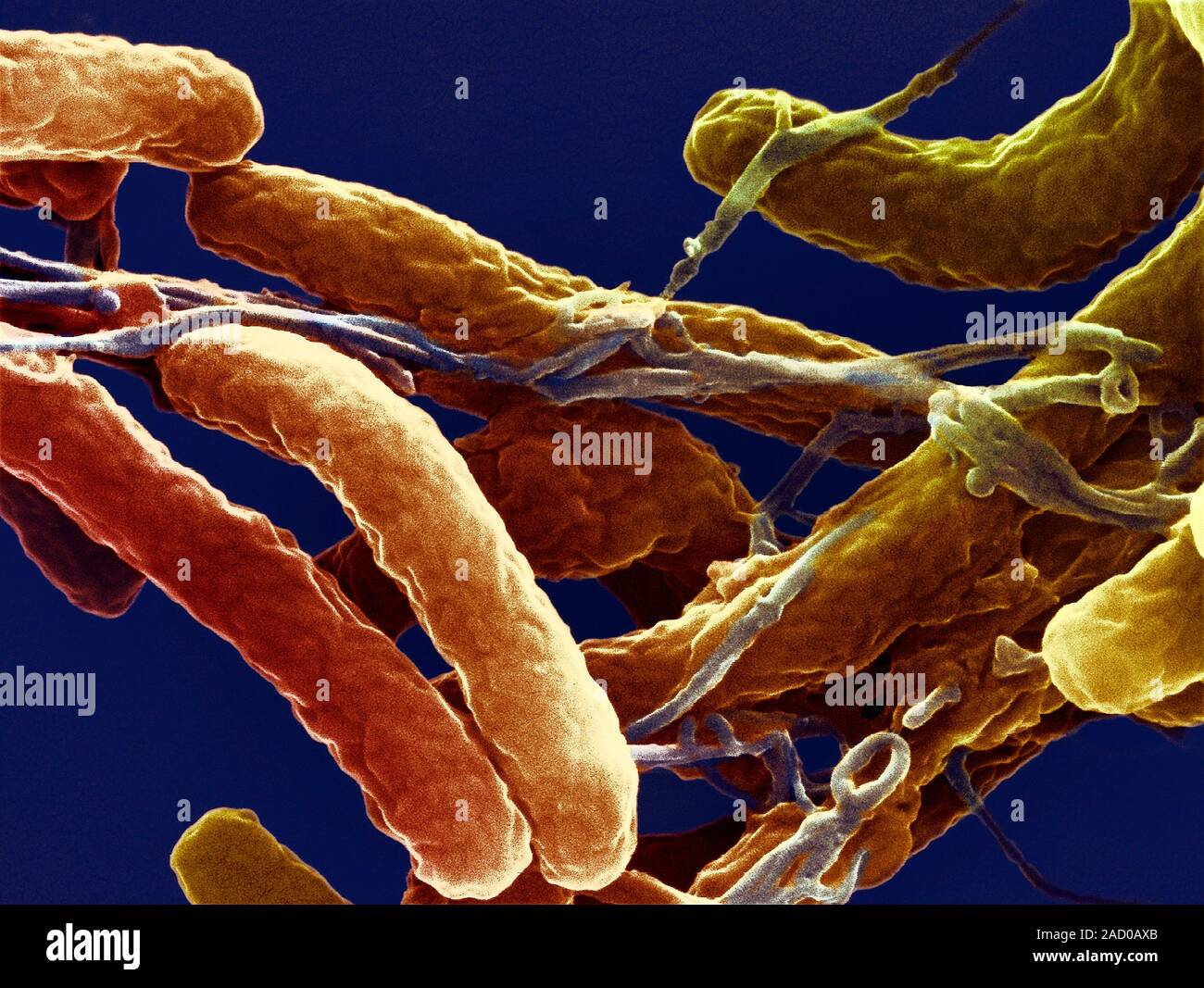 Cholera bacteria. Coloured scanning electron micrograph (SEM) of Vibrio ...