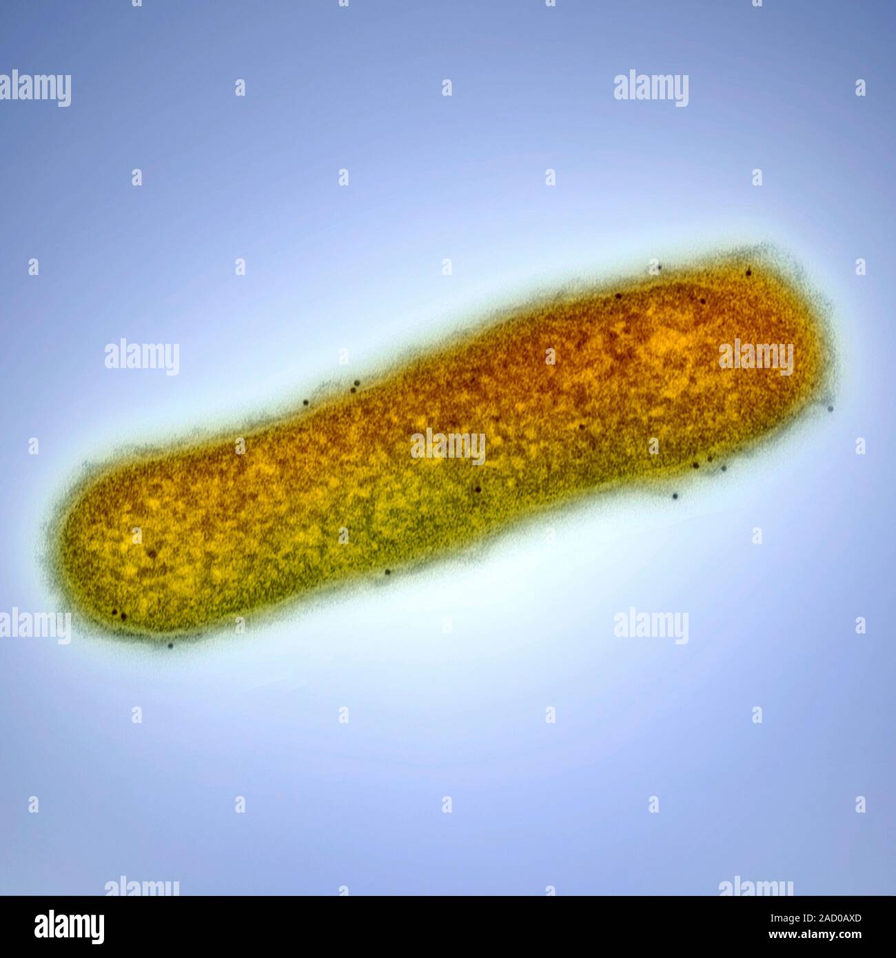 Cholera bacterium. Transmission electron micrograph (TEM) of a section ...