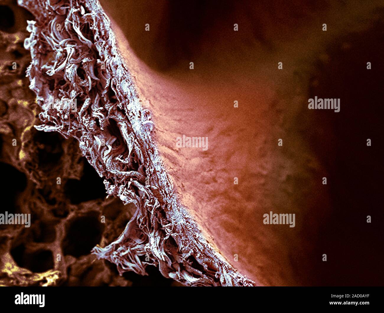 Lung tissue. Coloured scanning electron micrograph (SEM) of a section ...