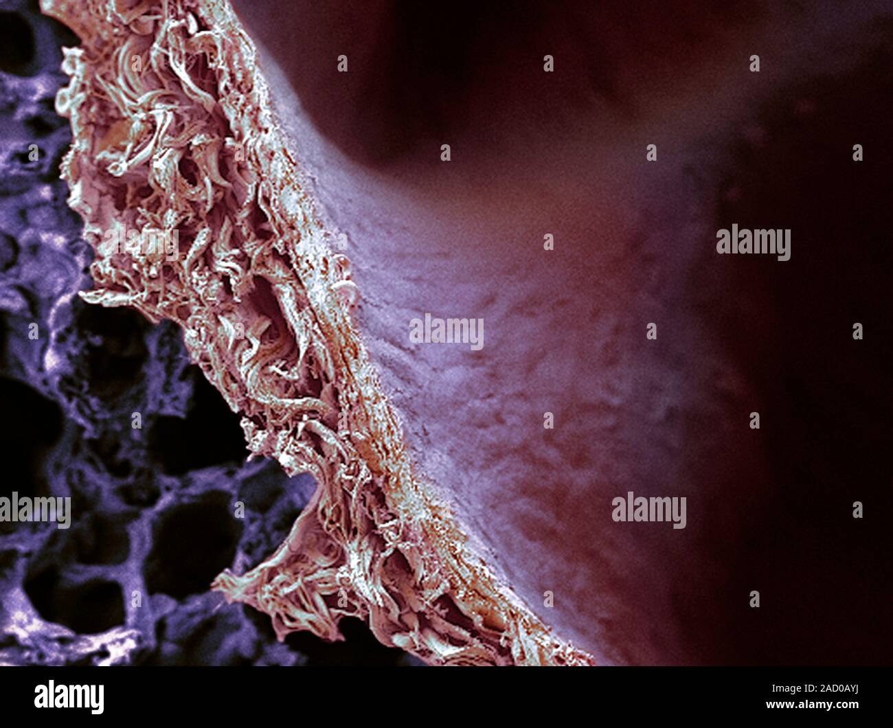 Lung tissue. Coloured scanning electron micrograph (SEM) of a section ...