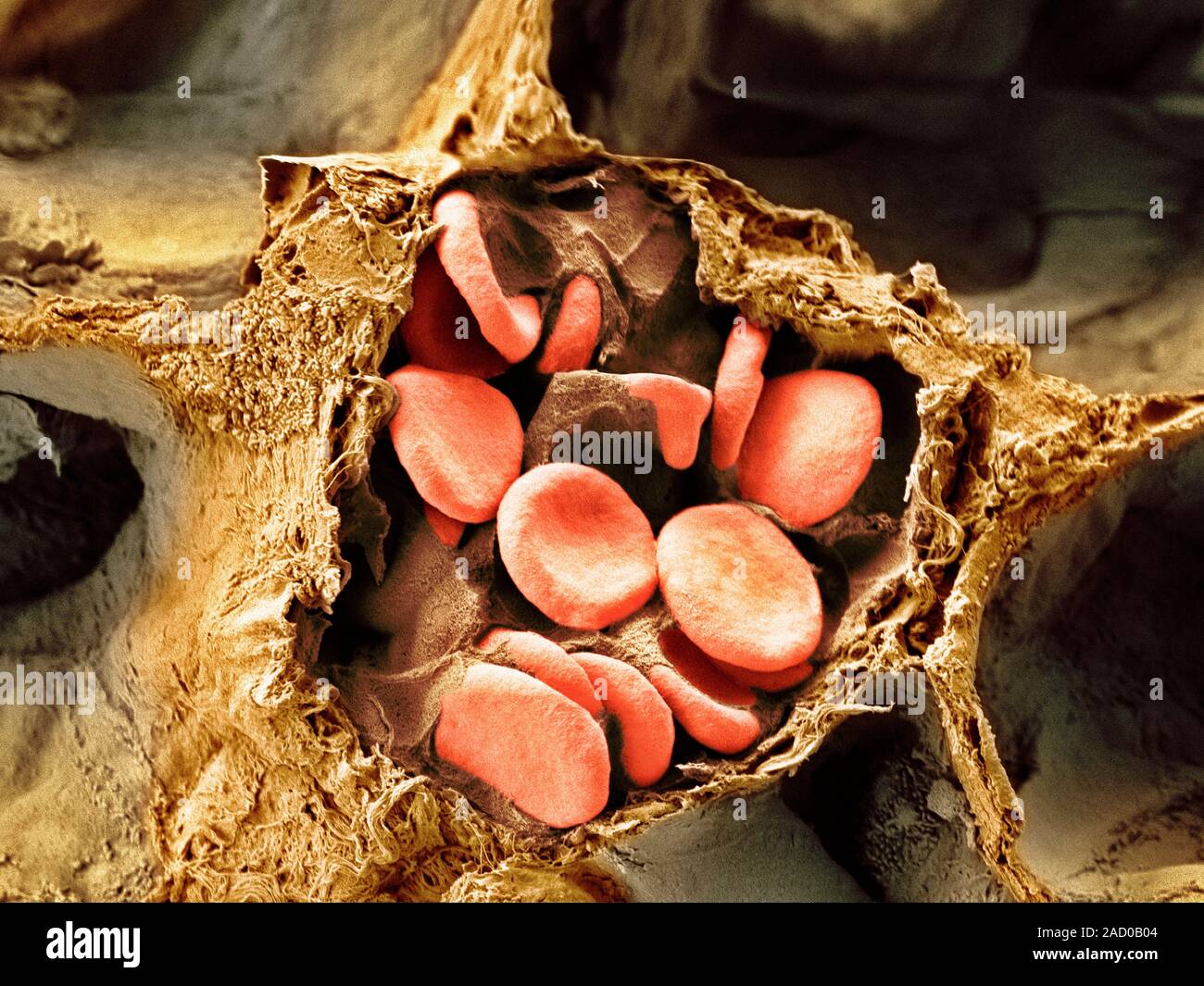 Blood vessel and alveoli in lung tissue. Coloured scanning electron ...