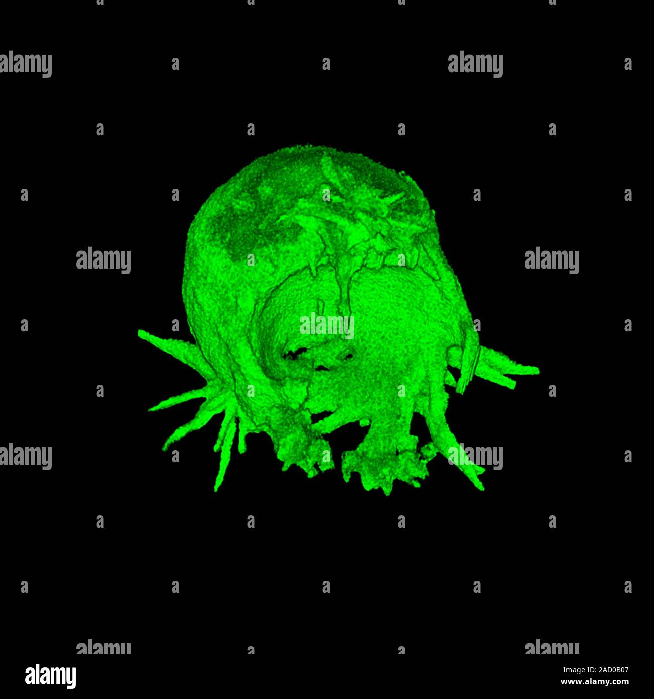 Cell transfection. 3D computed tomography (CT) scan of a Human ...