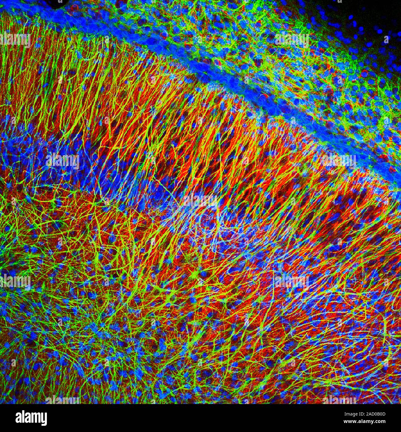 Brain cells. Fluorescence light micrograph of a section through brain tissue, showing numerous ...