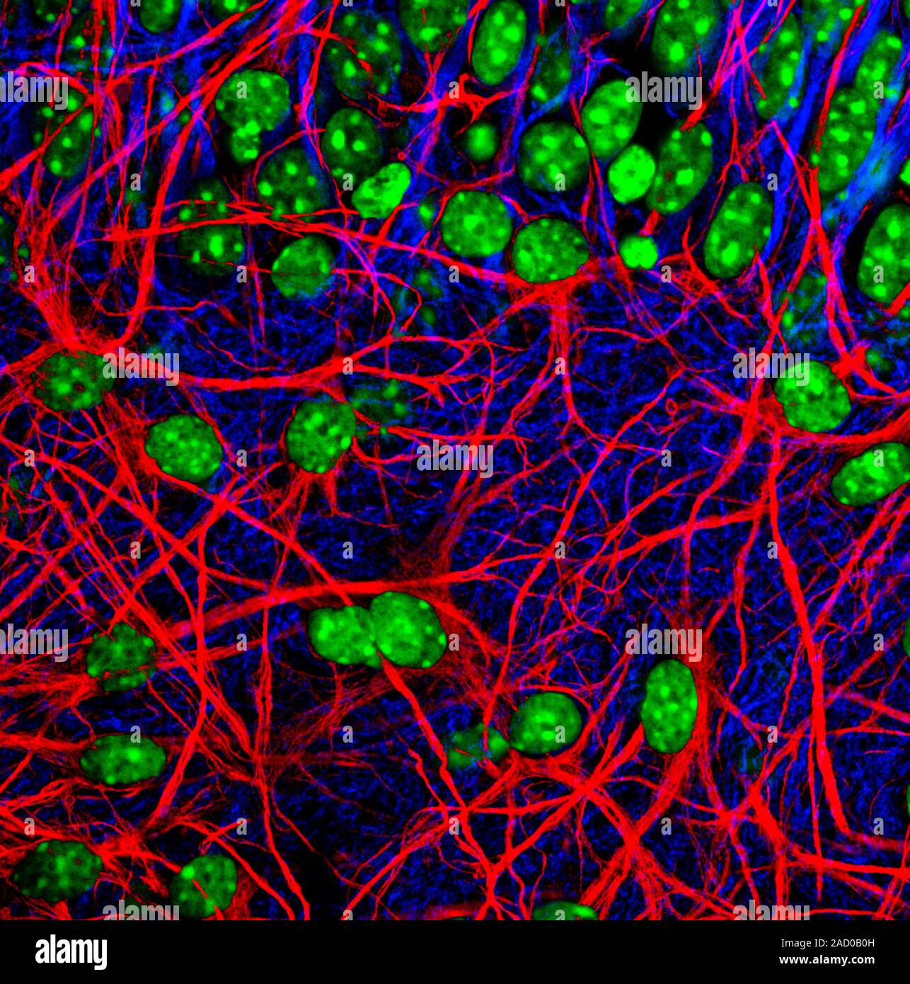 Brain cells. Fluorescence light micrograph of a section through brain ...