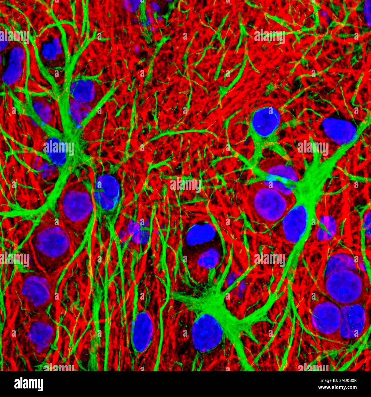 Brain cells. Fluorescence light micrograph of a section through brain ...
