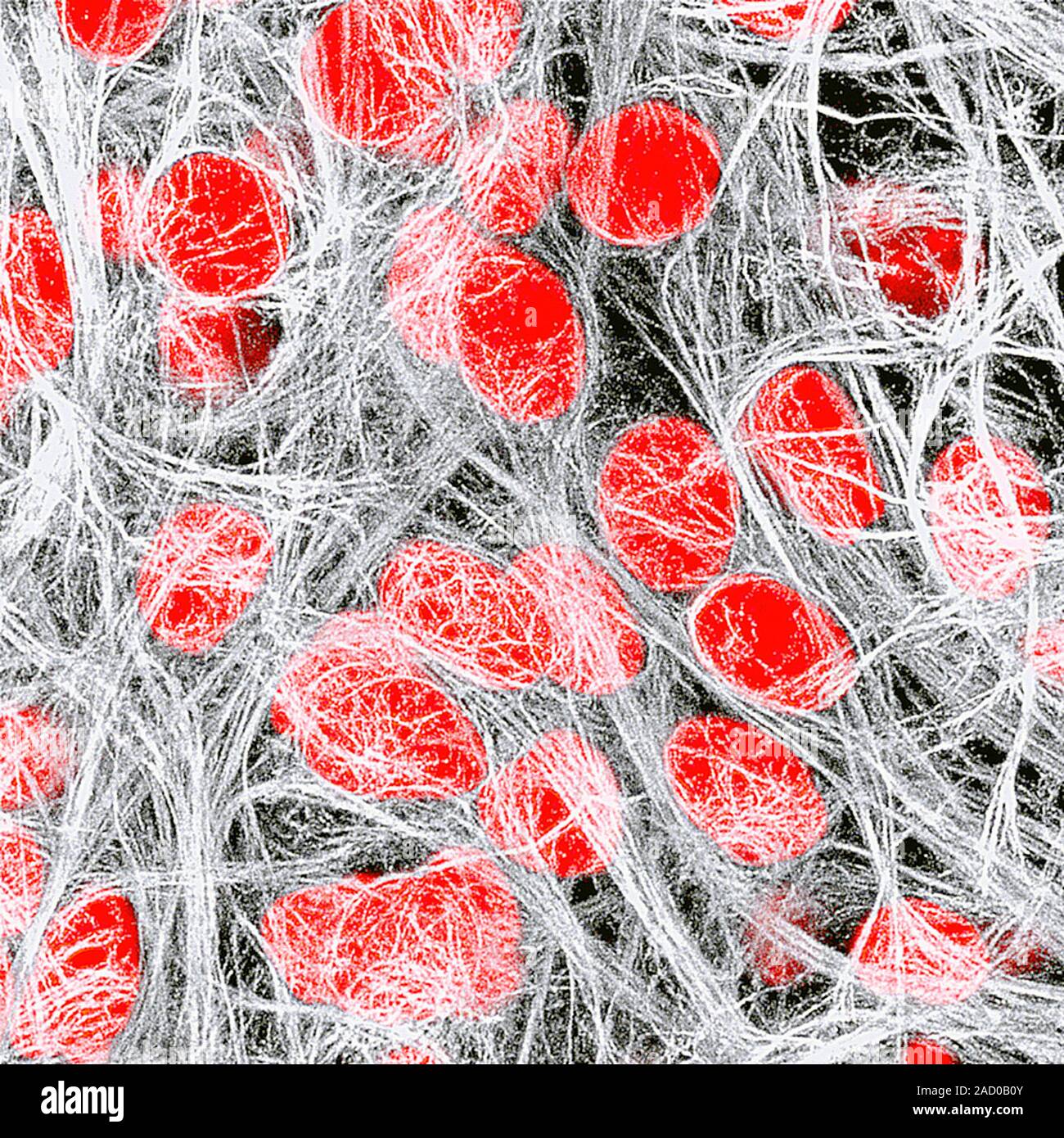 Brain cells. Light micrograph of a section through brain tissue ...