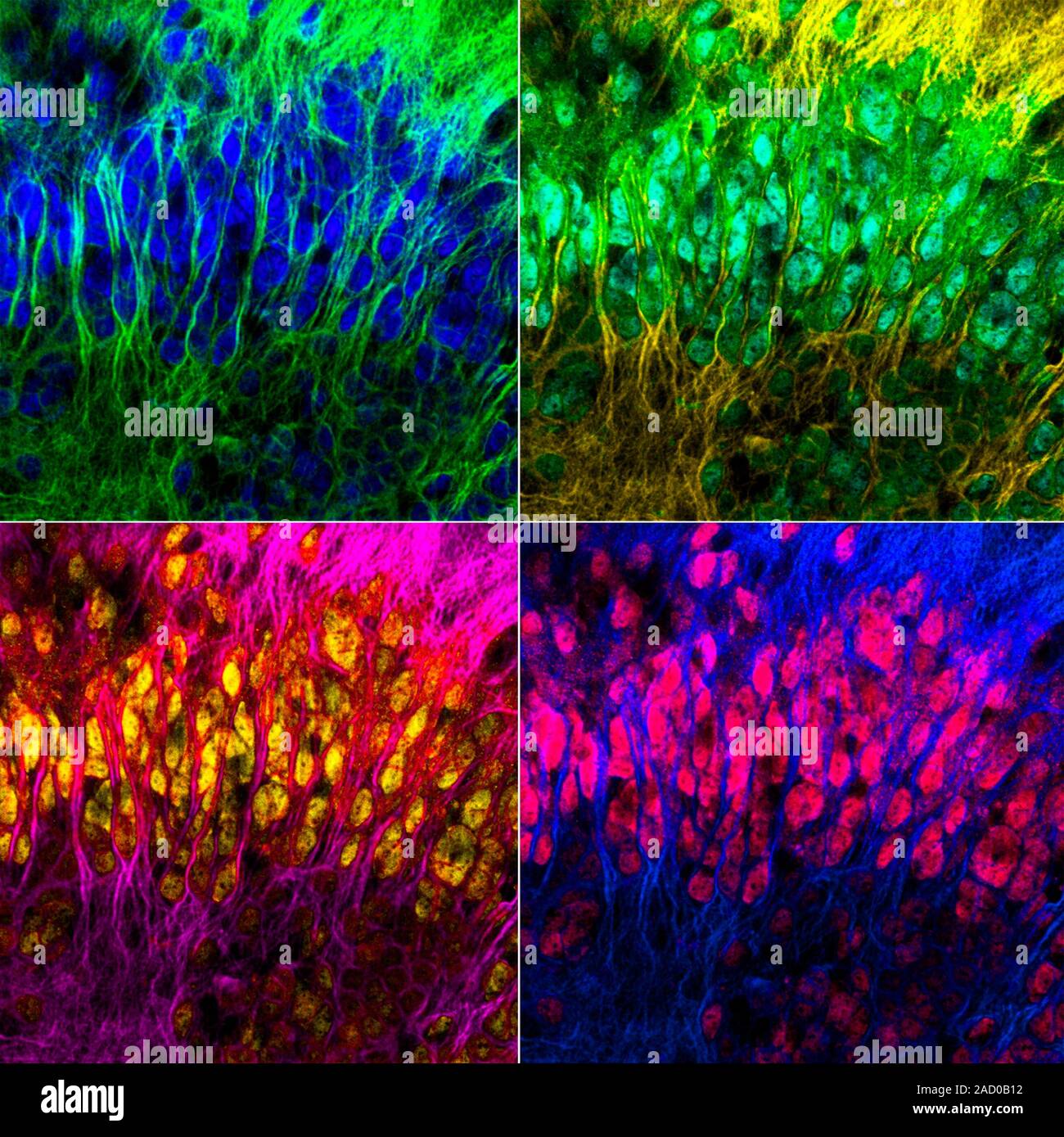 Brain cells. Collection of fluorescence light micrographs of sections ...