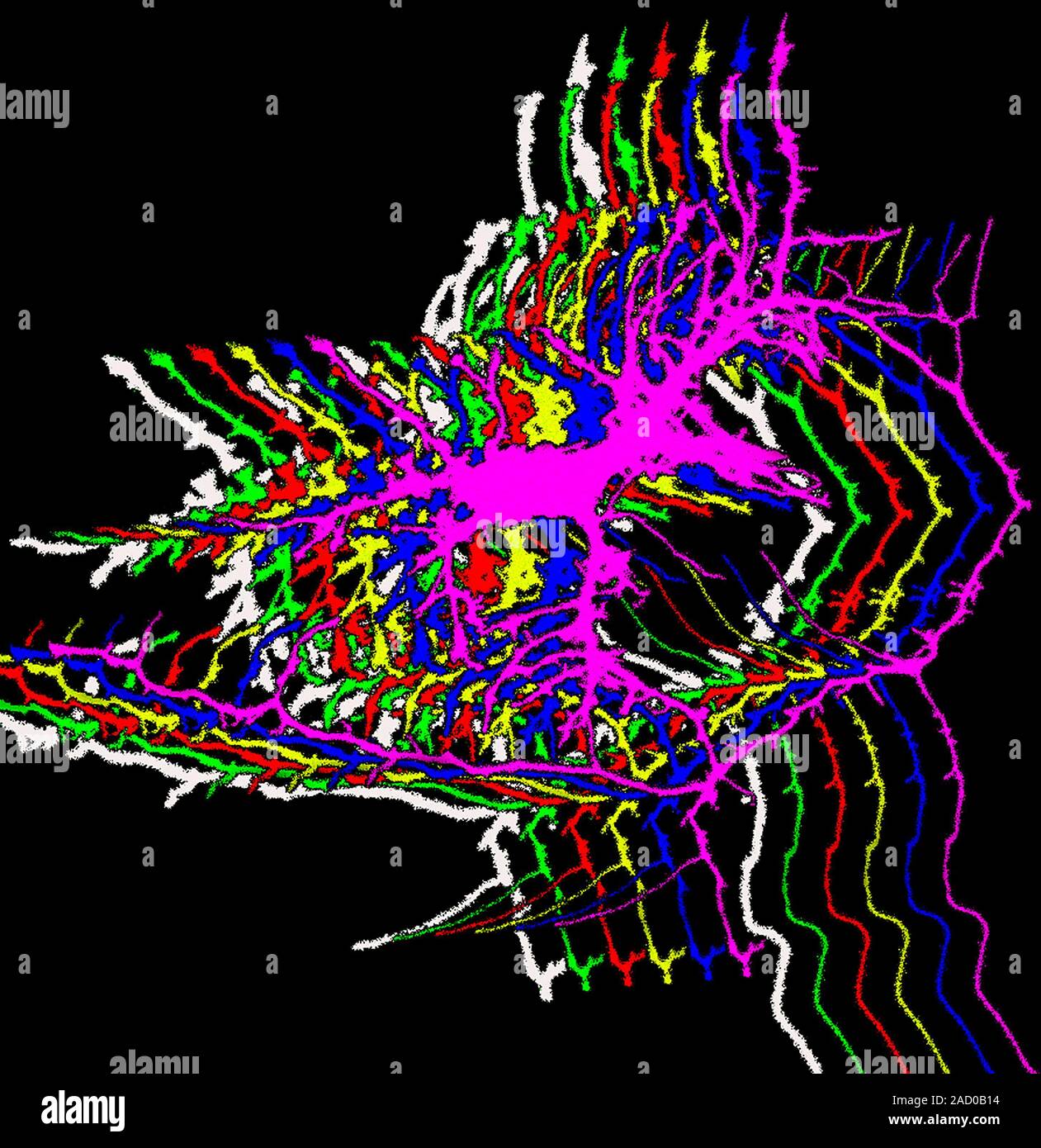 Brain activity. Montage of fluorescence light micrograph images showing ...