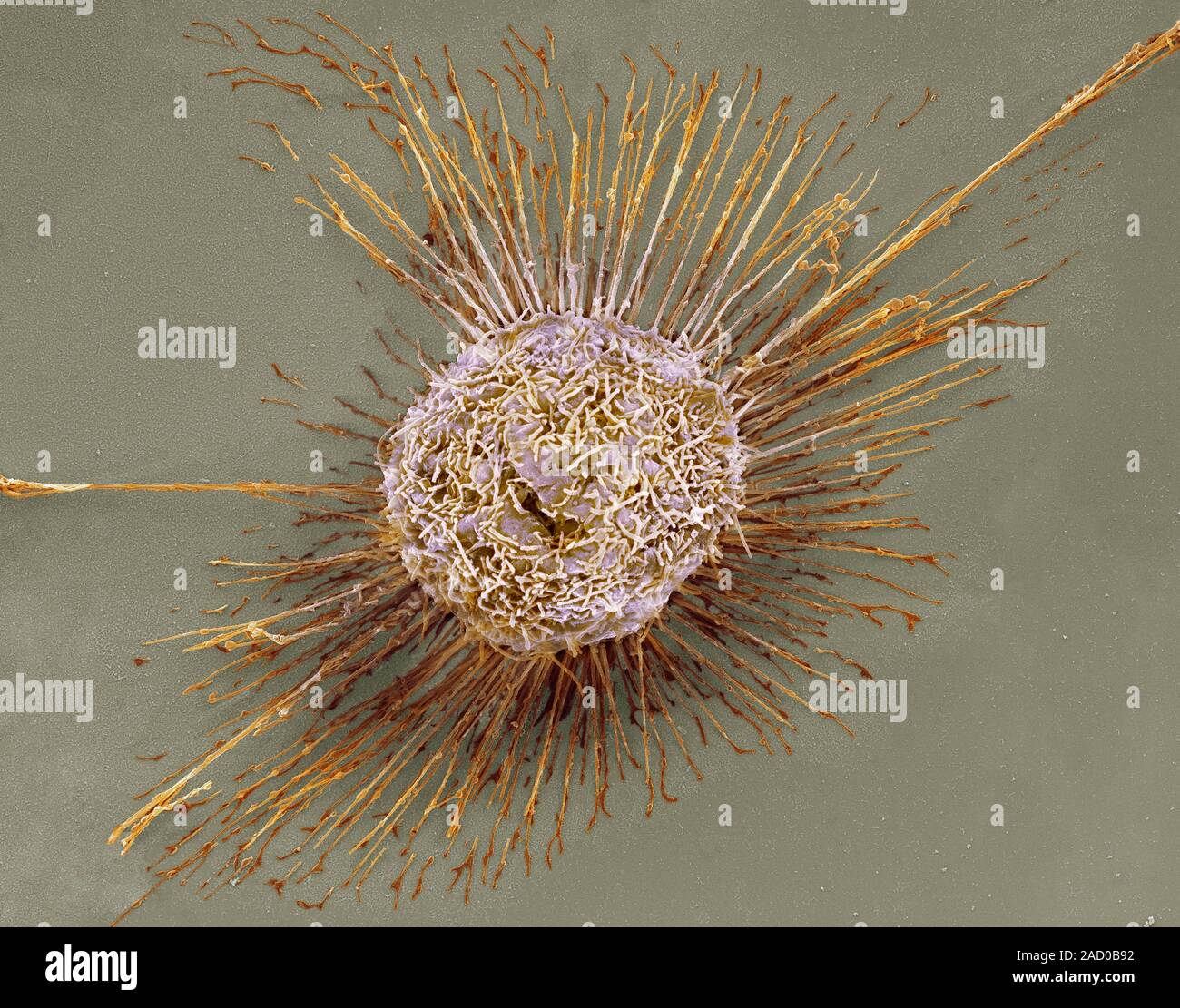 Lung epithelial cell. Coloured scanning electron micrograph (SEM) of a ...