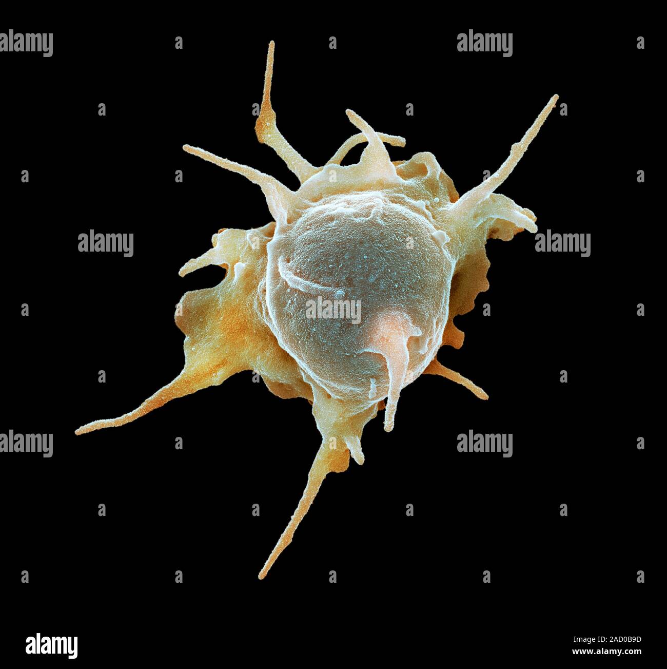 Blood platelet, coloured scanning electron micrograph (SEM). Platelets ...