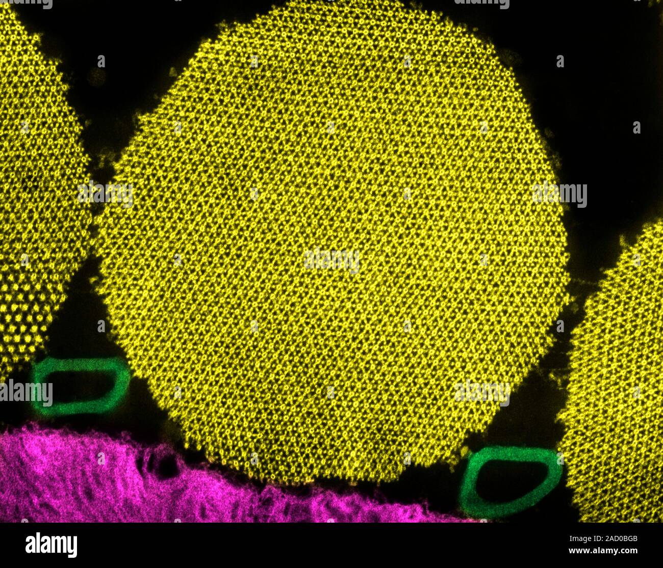 Myofibril muscle tissue, coloured transmission electron micrograph (TEM). This cross-section ...