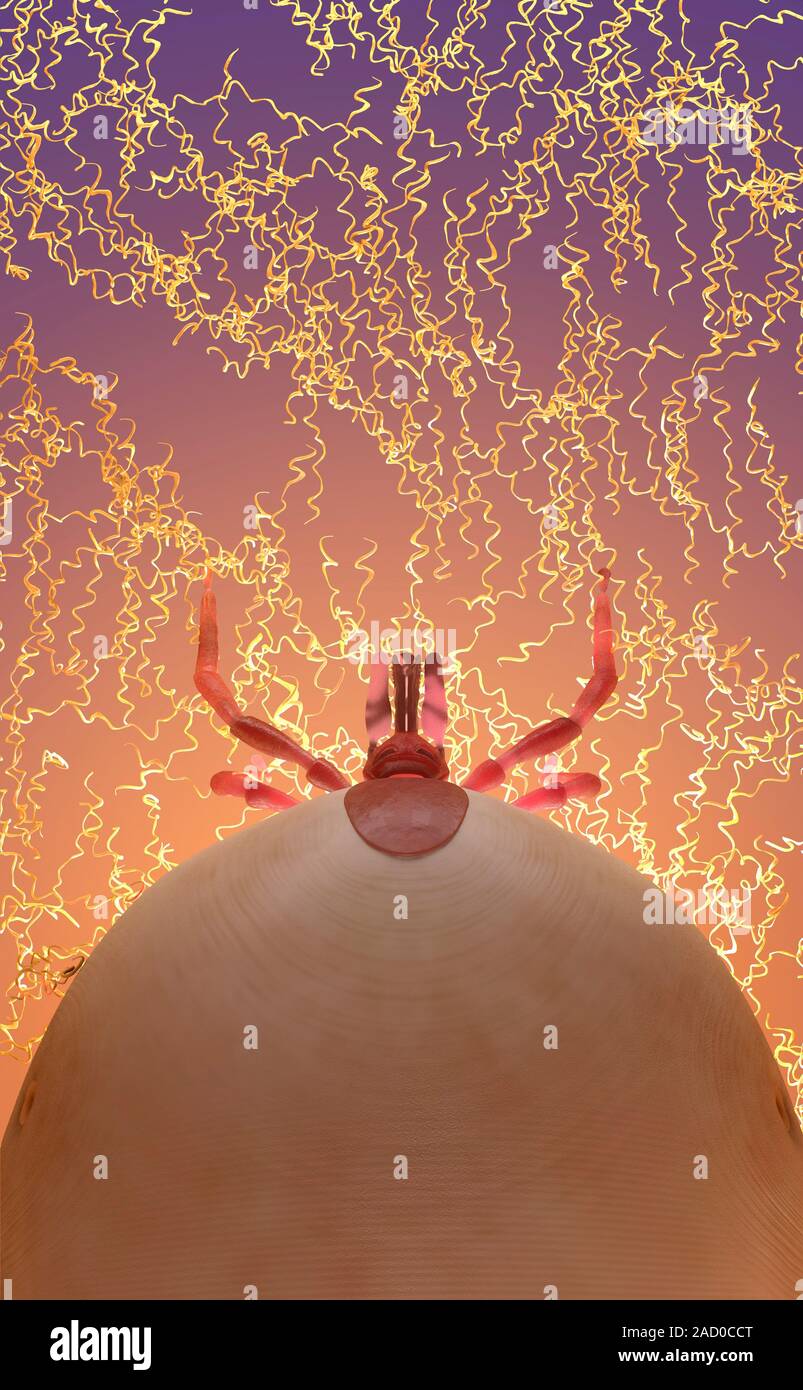Tick carrying Lyme disease bacteria, conceptual image. Computer ...