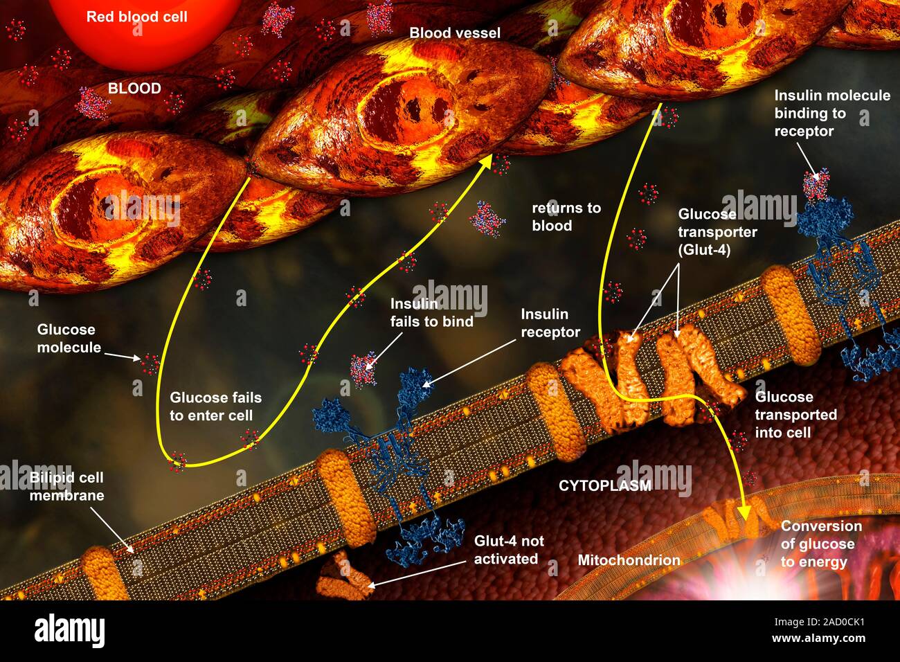 On the right, insulin binds with its receptor in a normal manner. This ...