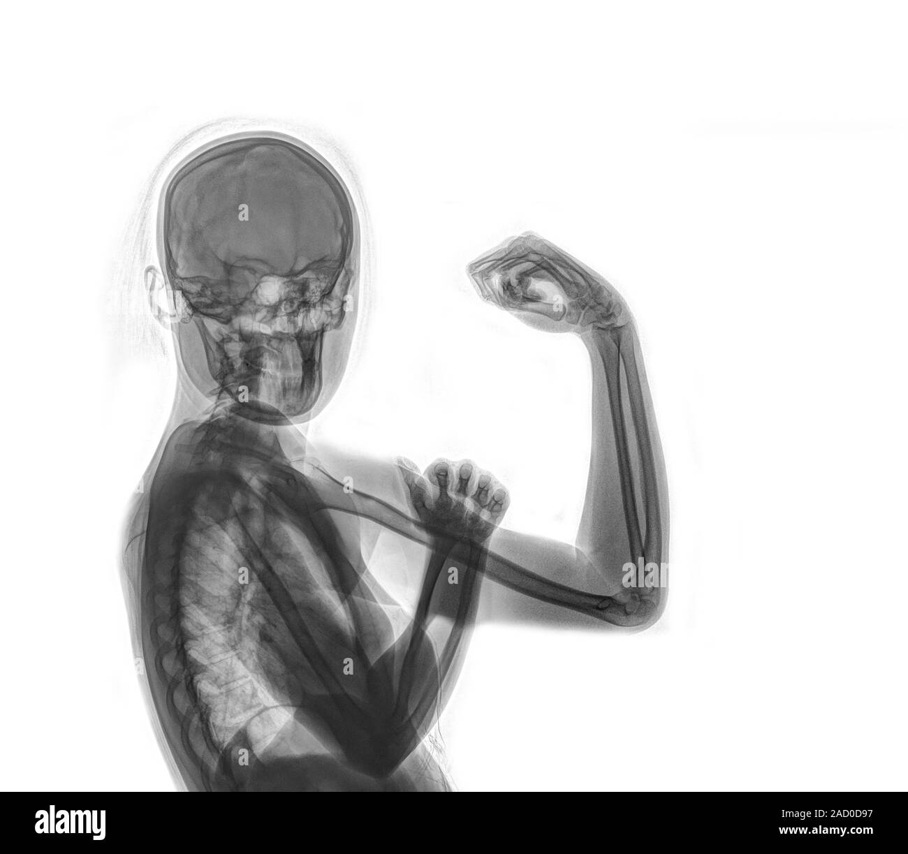 Woman's Power - We can do it - x-ray of a woman flexing her arm muscles ...