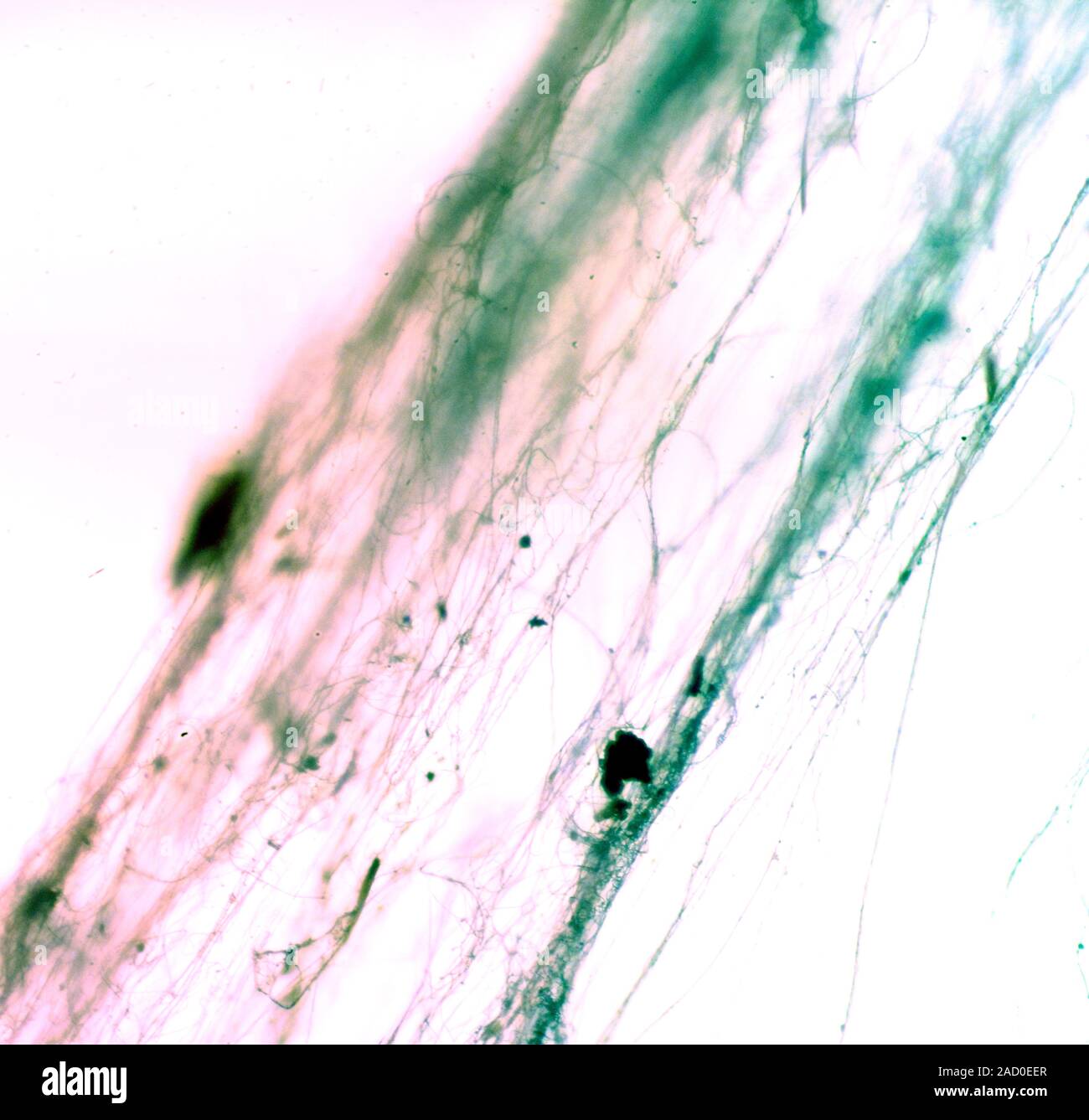 A spider web, spiderweb, spider's web, is a structure created by a ...