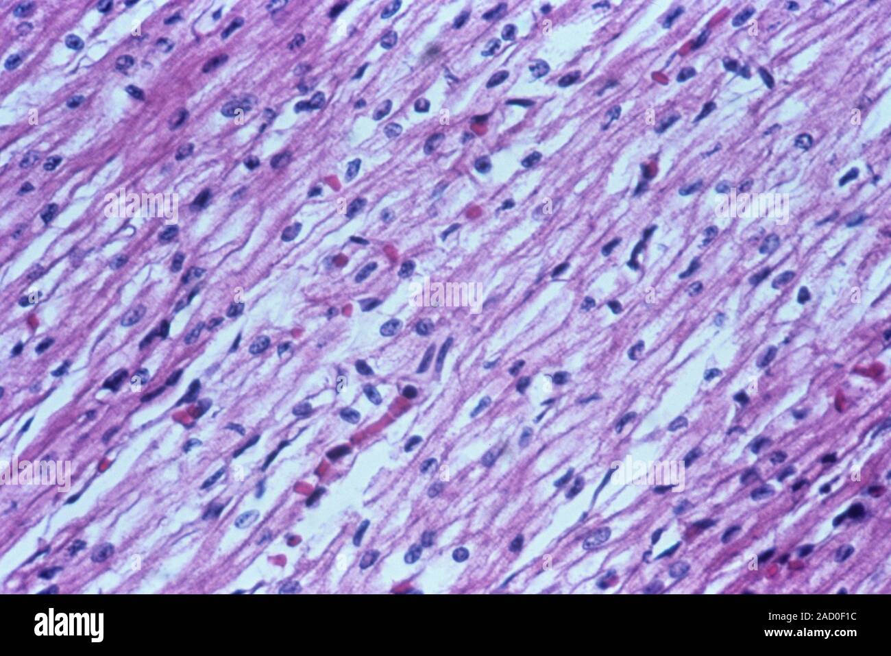 Heart glycogen. Light micrograph of a section through the myocardium ...