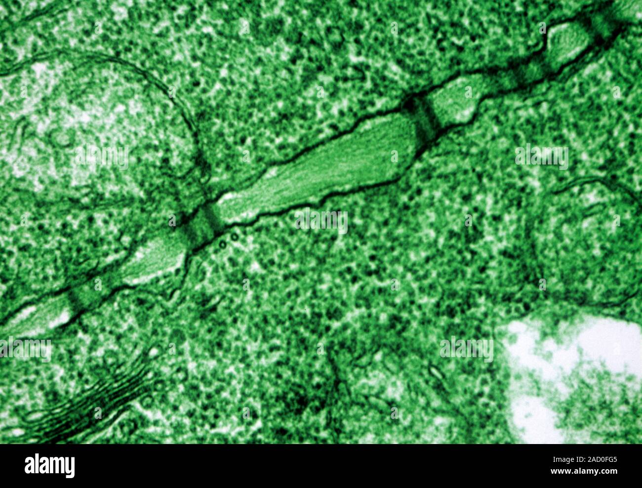 Plasmodesmata plant cell junctions, coloured transmission electron ...