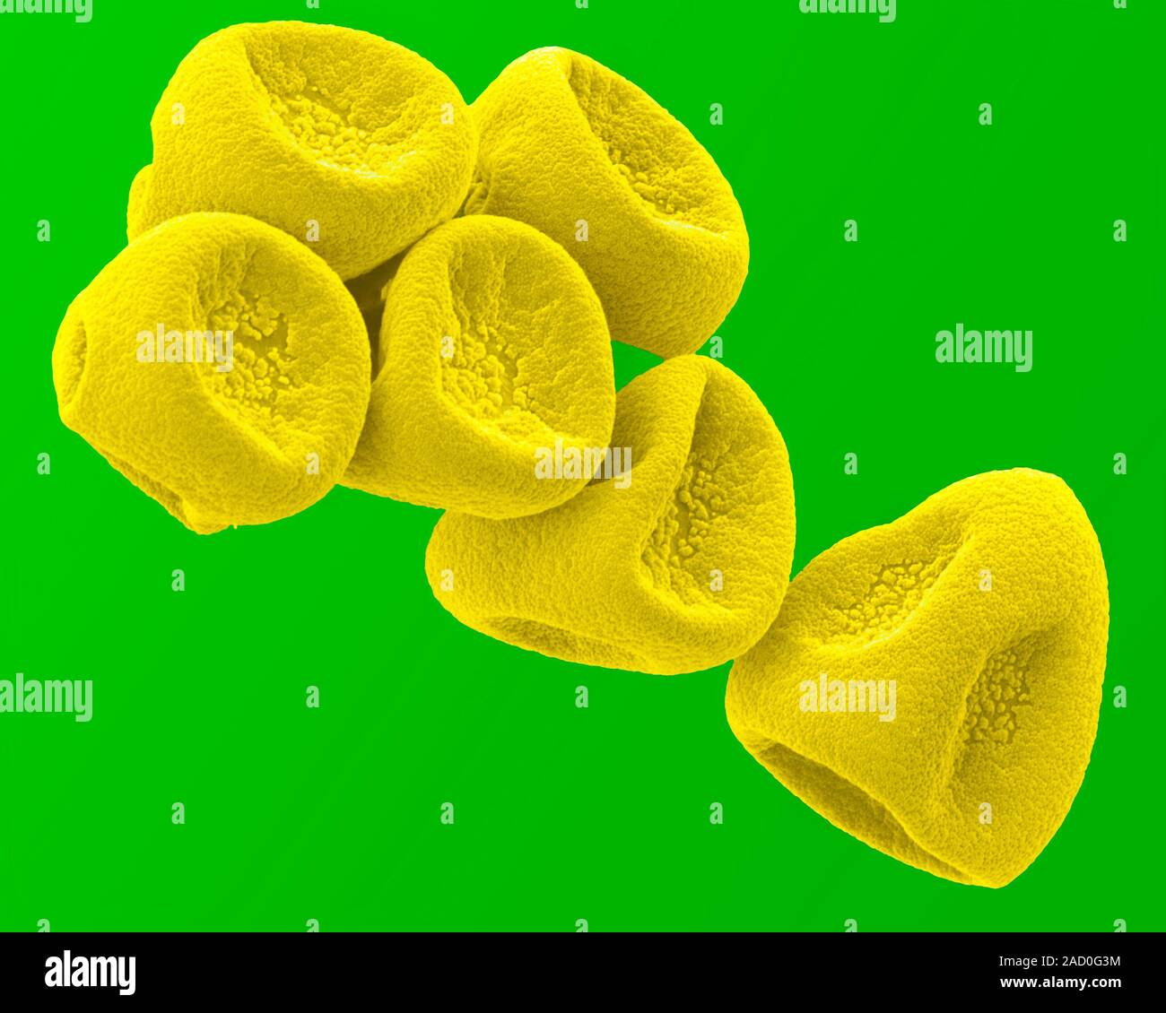 Daffodil pollen. Coloured scanning electron micrograph (SEM) of pollen ...