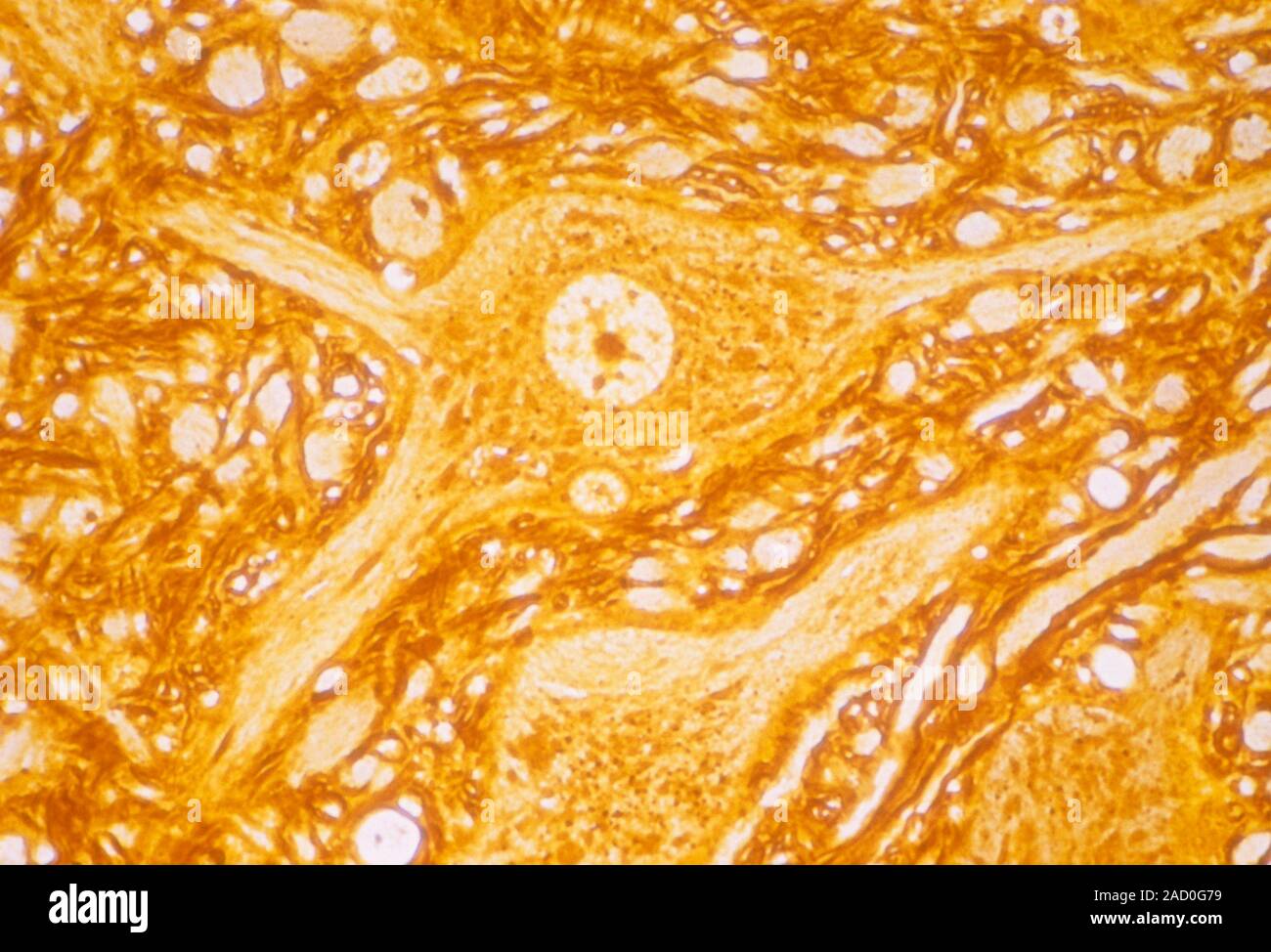 Motor neurone. Light micrograph of a motor nerve cell (motor neurone ...