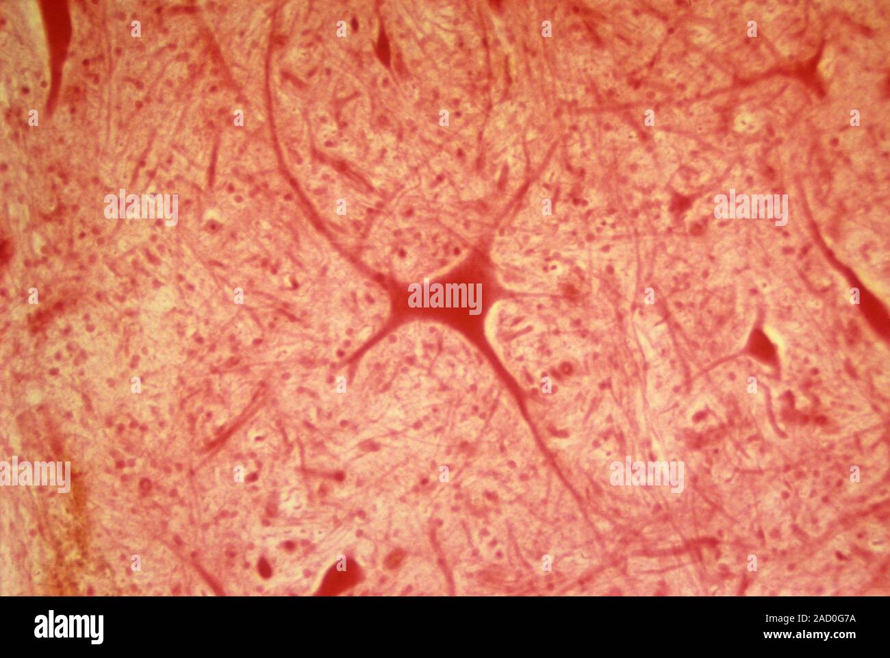 Multipolar neuron. Light micrograph of a multipolar nerve cell (neuron ...