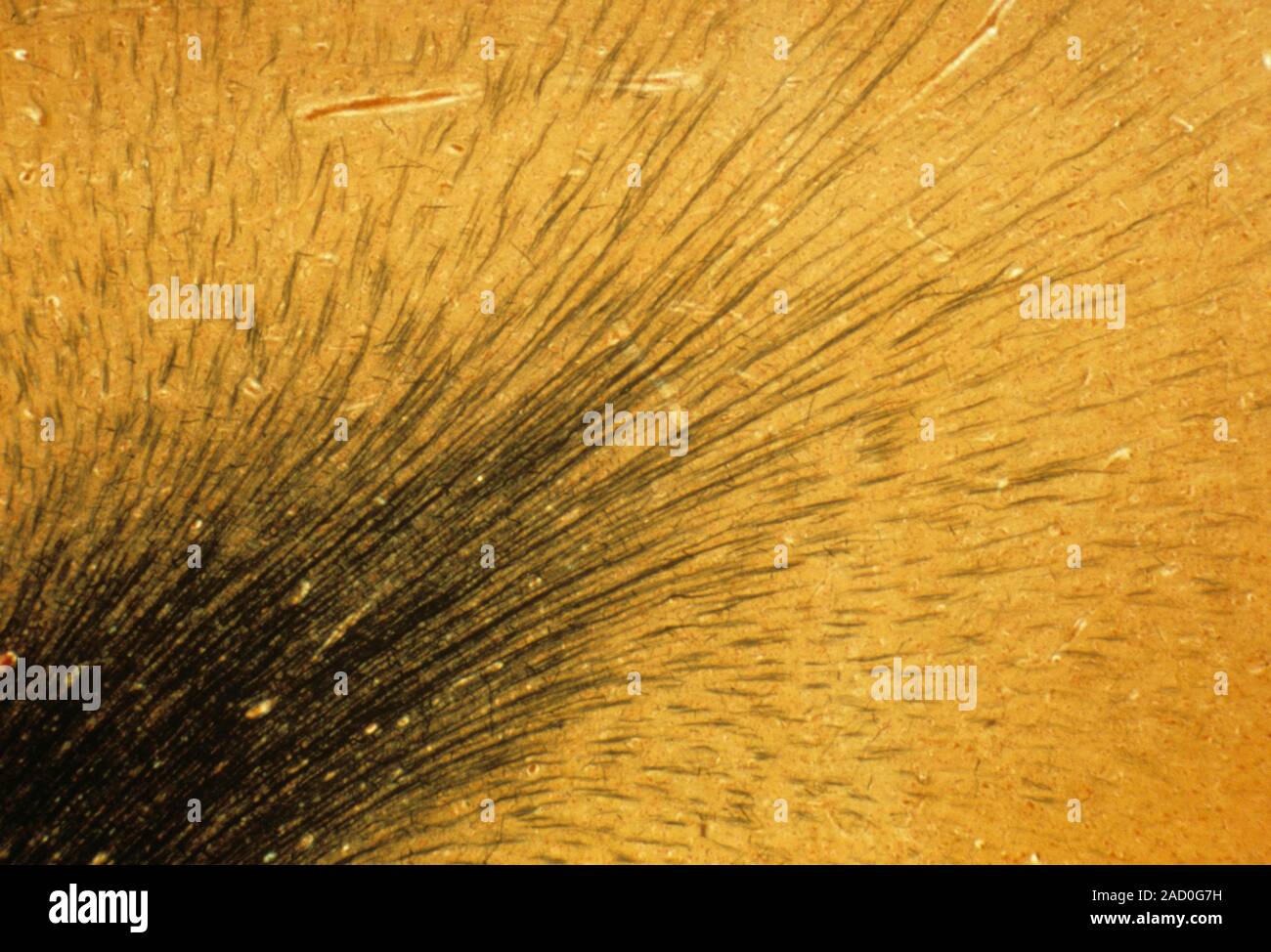 Human brain. Light micrograph of a section of tissue in a normal human ...