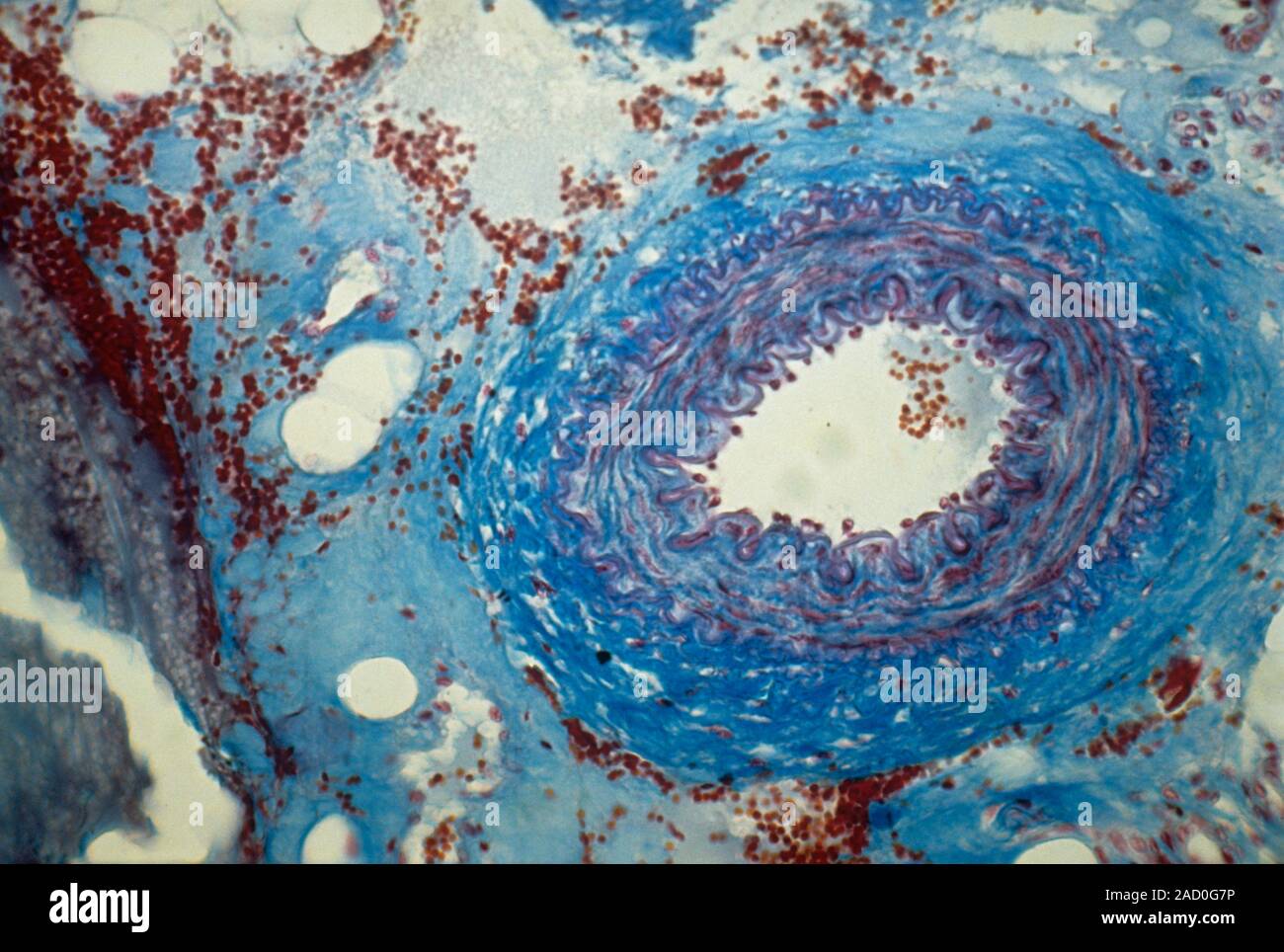 Arteriole. Light micrograph of a section through a small human artery ...