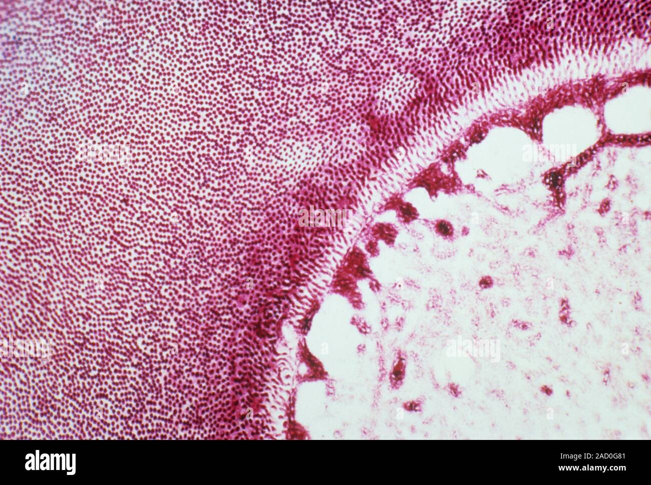 Dentine (or dentin) and pulp cavity. Light micrograph of a section ...