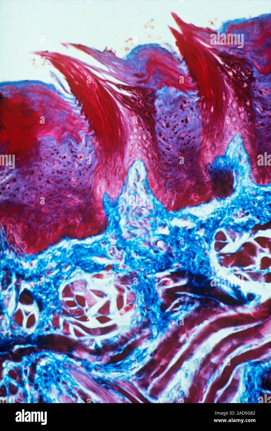 Tongue papillae. Light micrograph of section through a human tongue ...